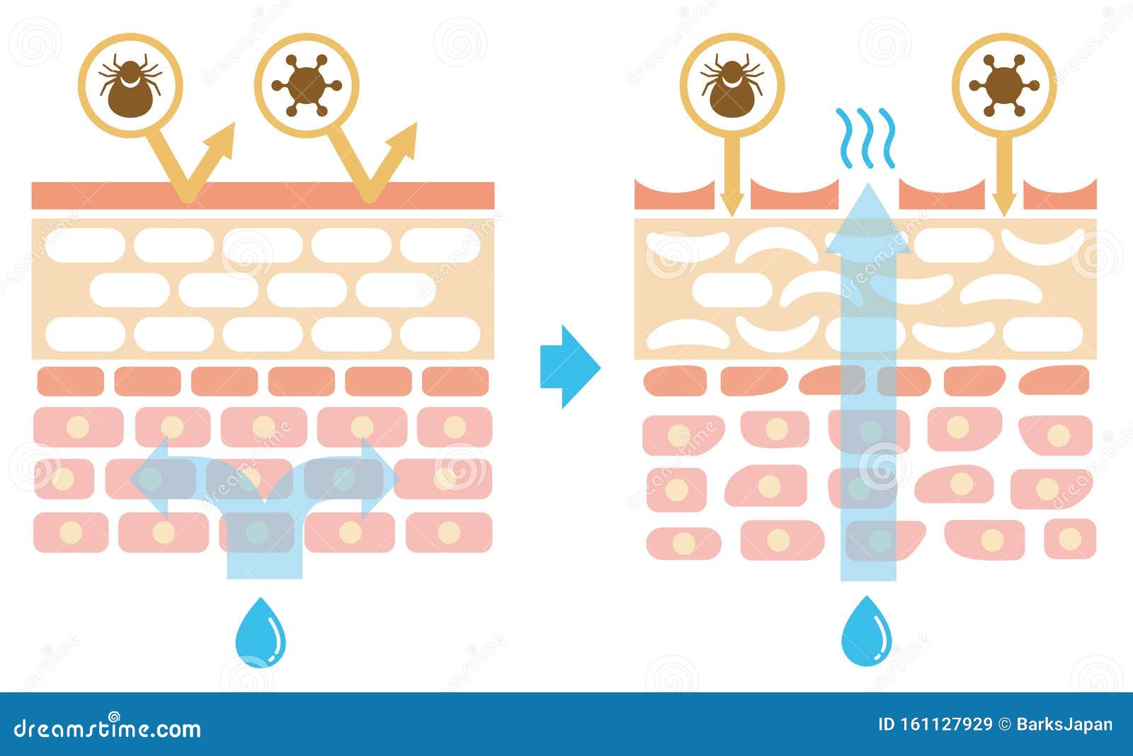 Sectional View of the Skin Illustration. Comparison of Protection ...