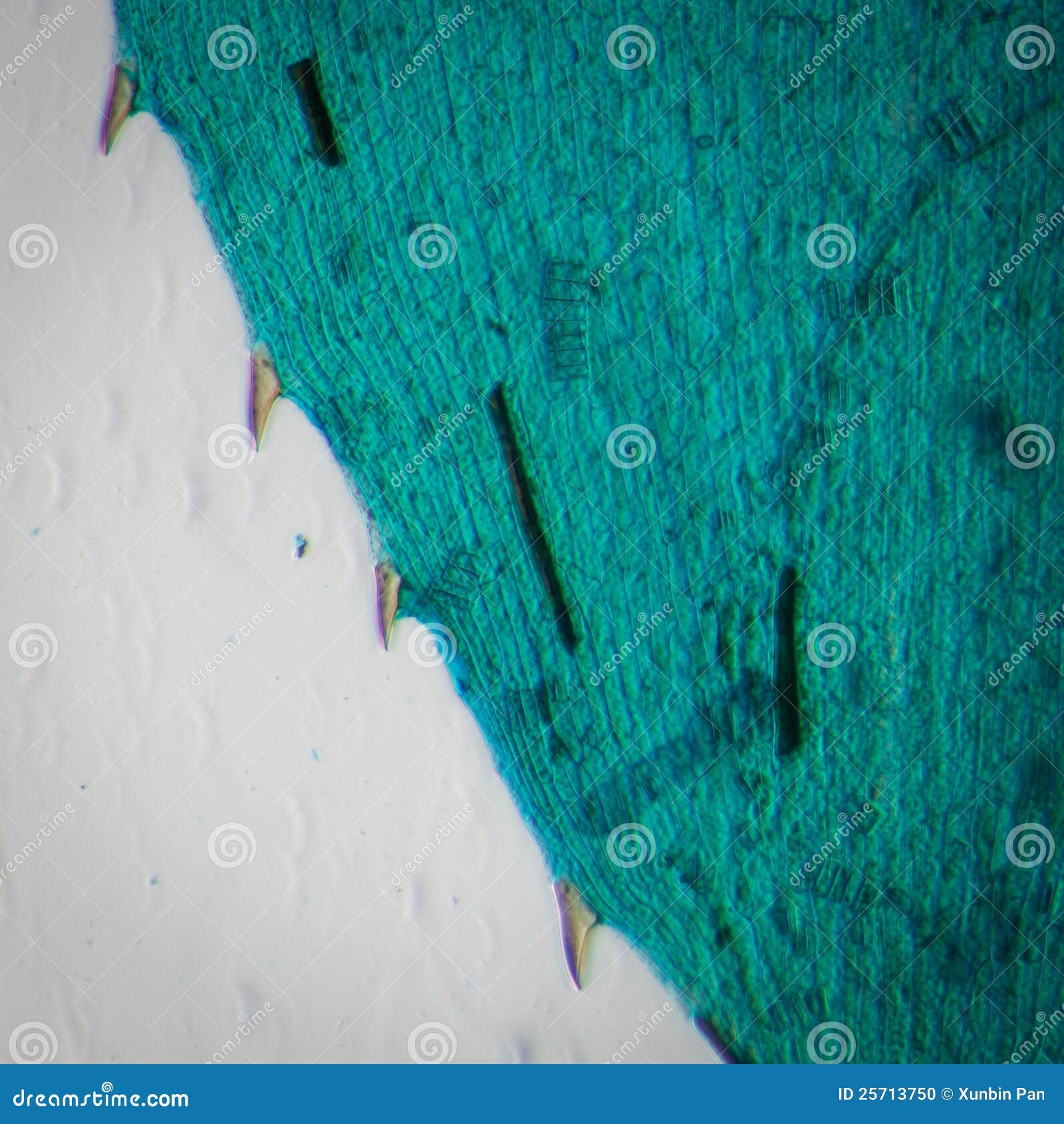 Micrograph Of A Black Bumblebee Sitting On A Spiny Shell Of A Chestnut ...