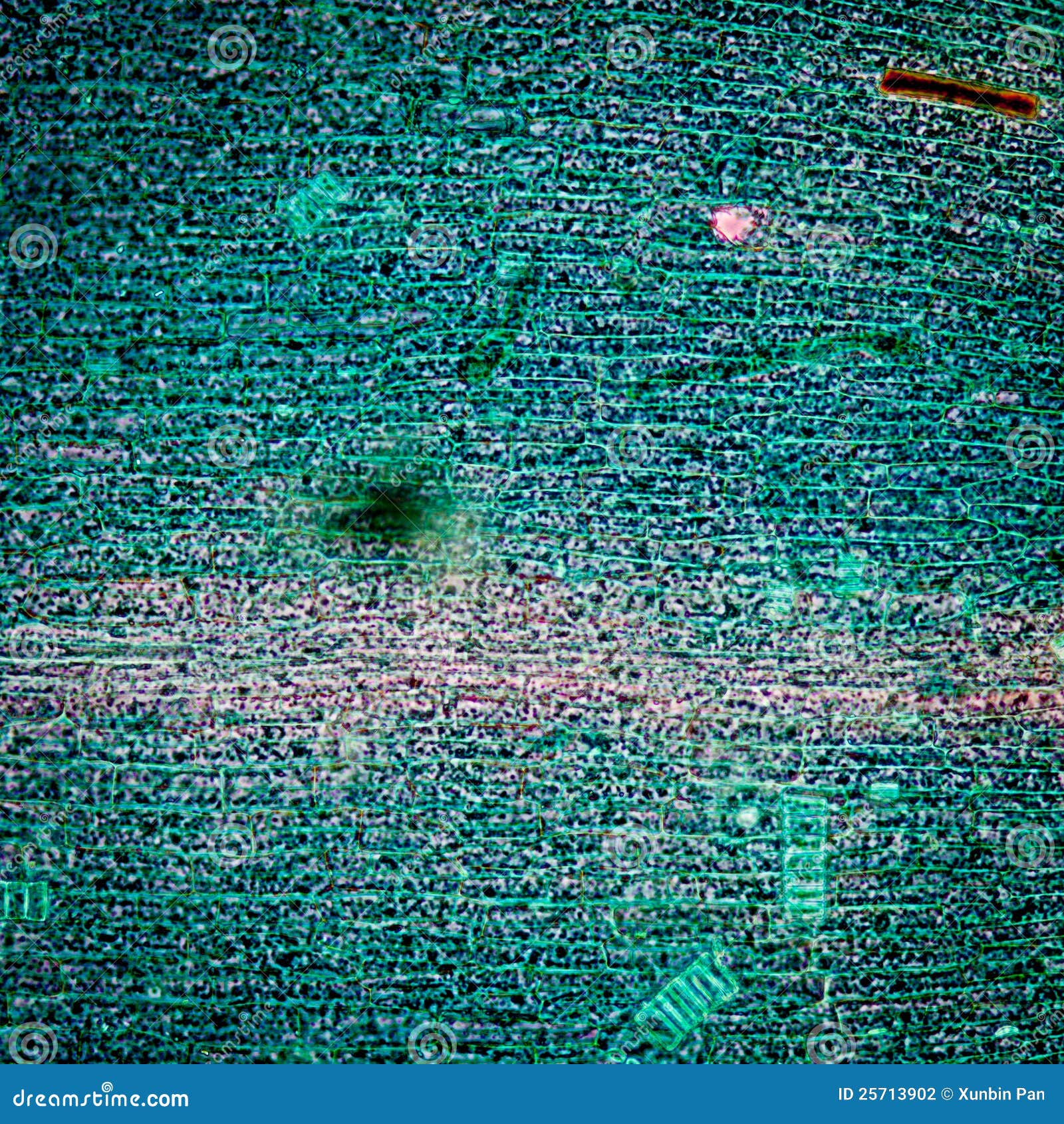 Micrograph Of A Black Bumblebee Sitting On A Spiny Shell Of A Chestnut ...