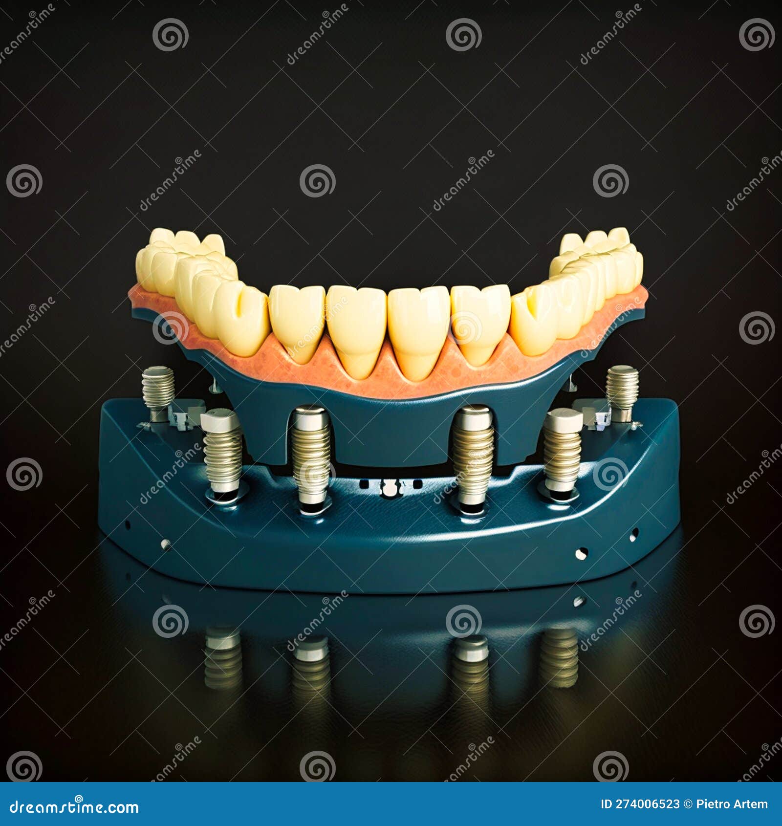 Black Background Full Arch Fixed Dental Prostheses, Generative AI Stock ...