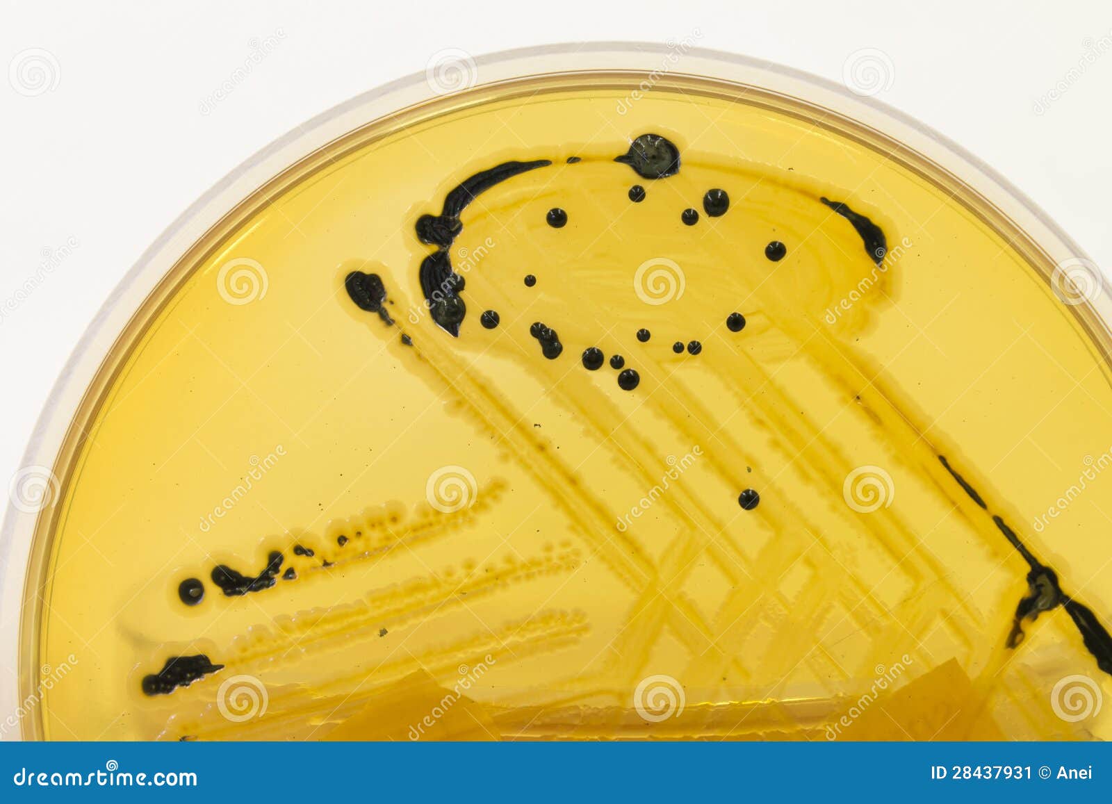 Black Bacterial Colonies Of Salmonella Species On Salmonella Shigella ...