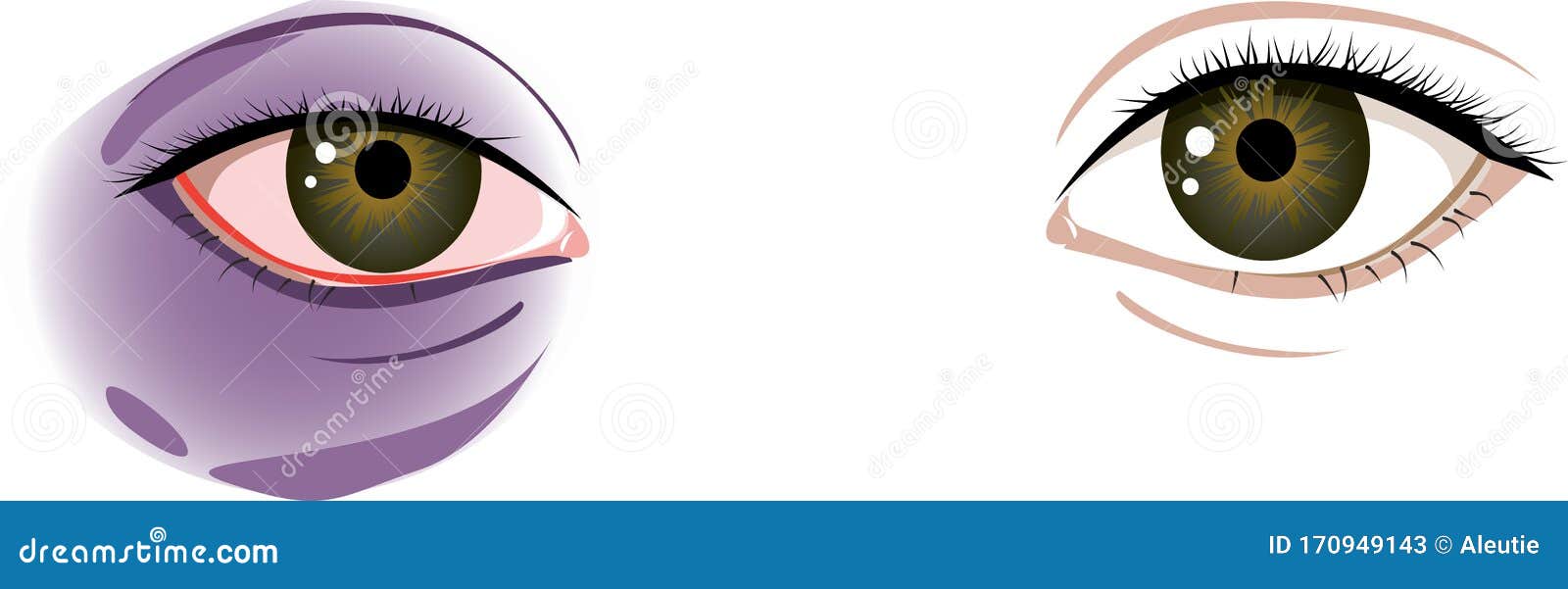 Black eye illustration stock vector. Illustration of symbol - 170949143
