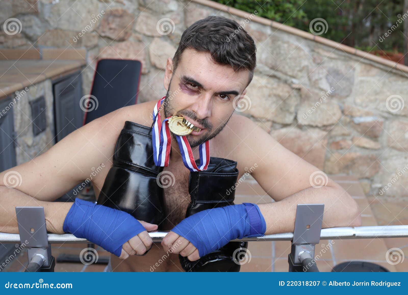 Black Eyed Man Winning a Boxing Competition Stock Image - Image of ...
