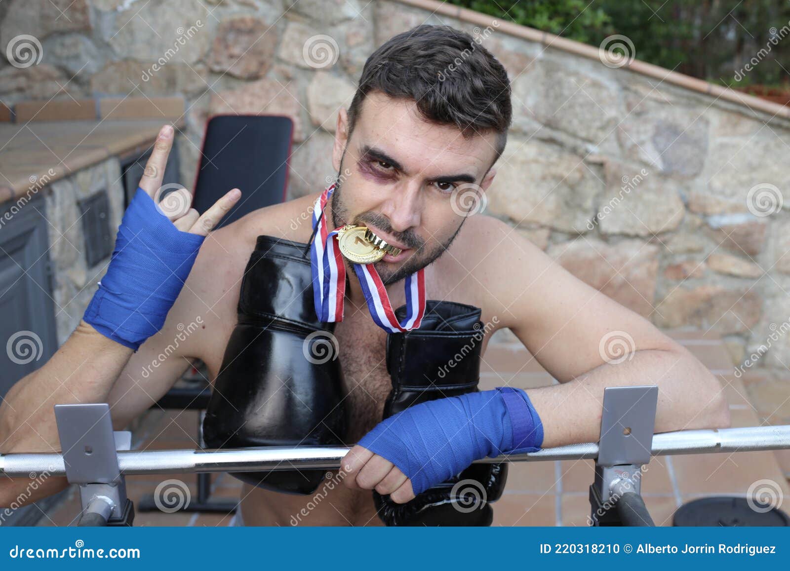 Black Eyed Man Winning a Boxing Competition Stock Photo - Image of ...