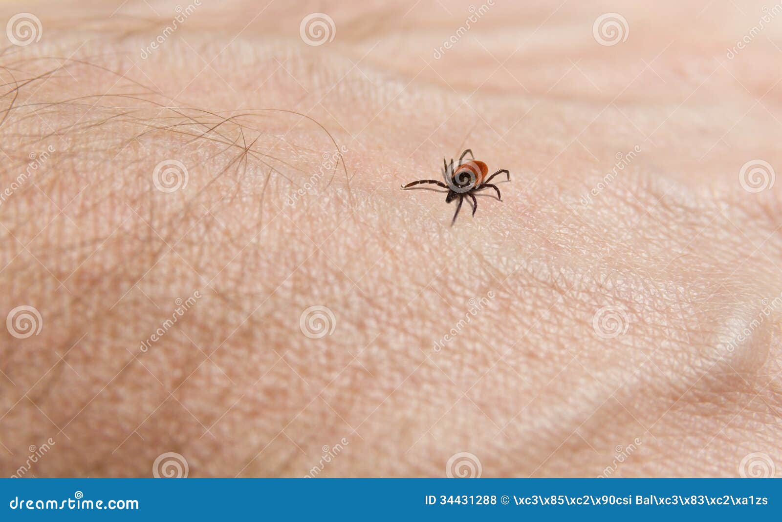 Black Legged Deer Tick Macro Stock Photo - Image of hand, macro: 34431288