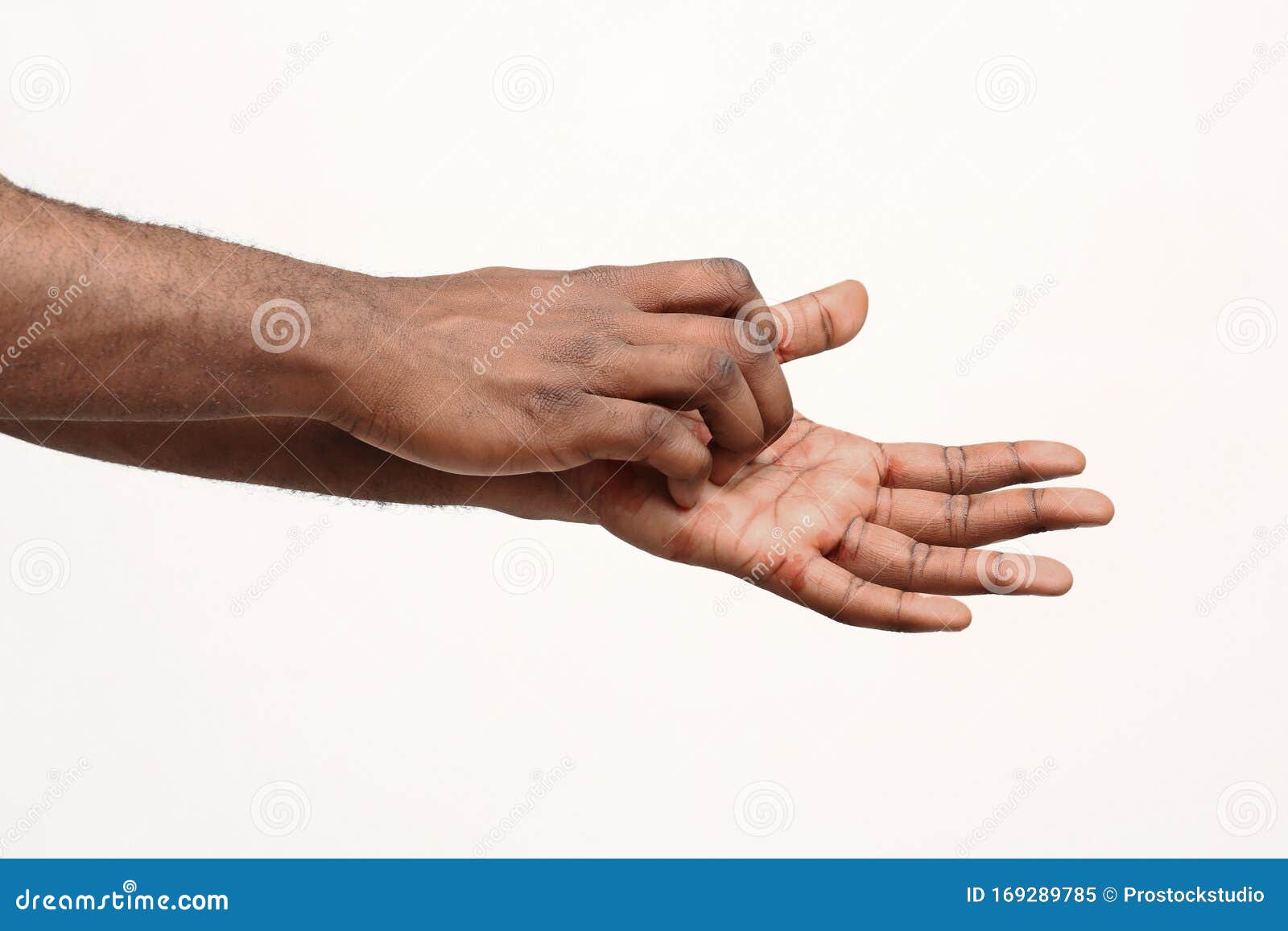 Black Man Scratching Itch on His Hand Stock Image - Image of hurt ...