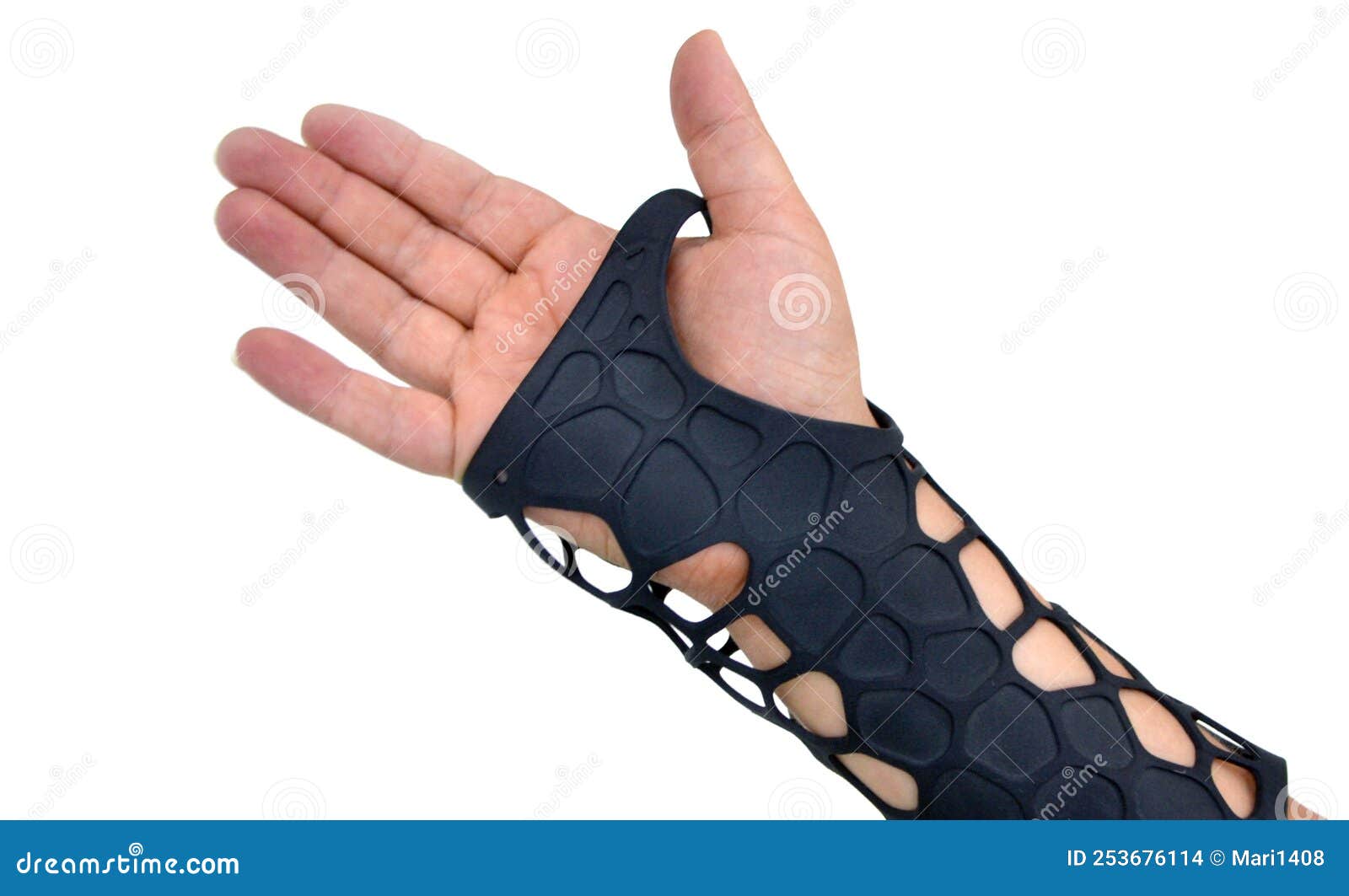 Black Orthopedic Plastic Prosthesis Printed on Powder 3D Printer on ...