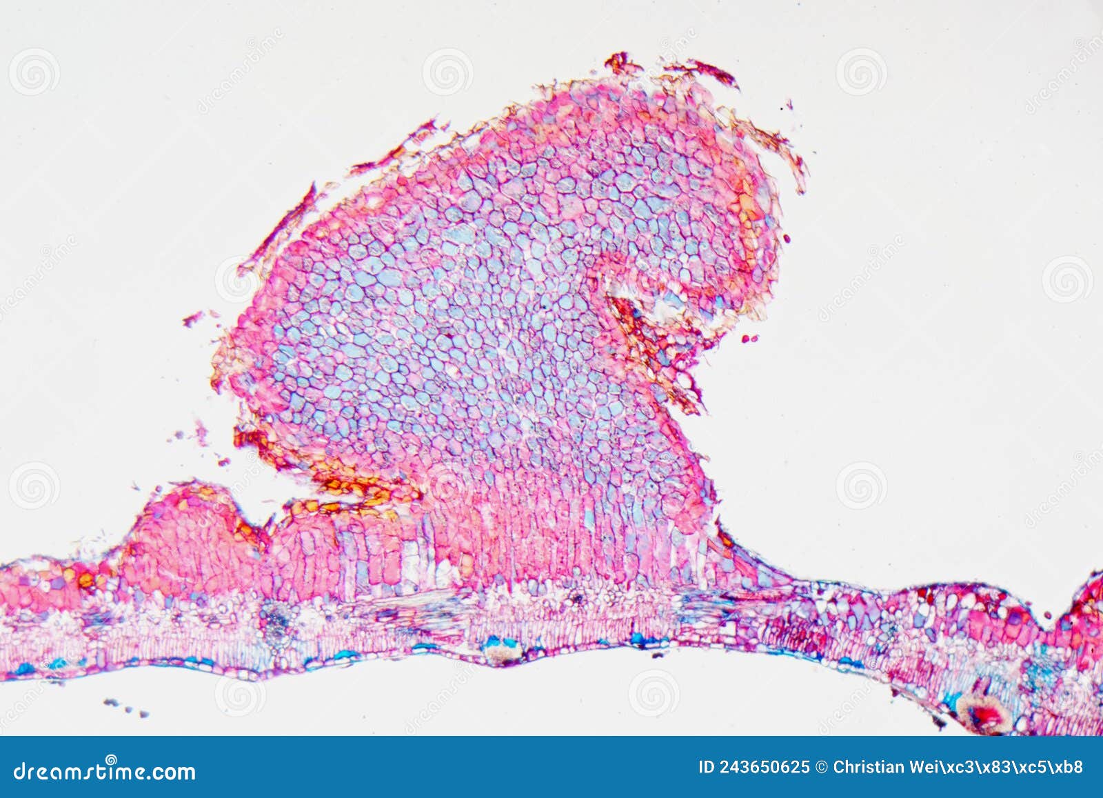 Black Rust, Puccinia Graminis, on a Barberry Leaf Under the Microscope ...