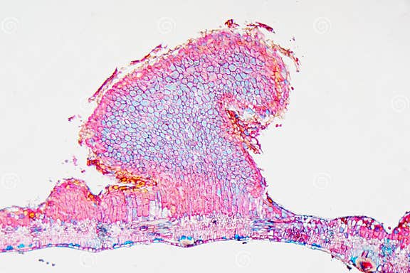 Black Rust, Puccinia Graminis, on a Barberry Leaf Under the Microscope ...
