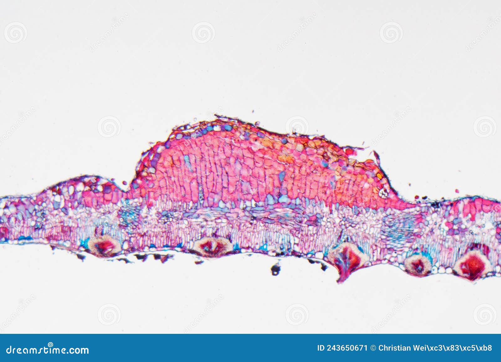 Black Rust, Puccinia Graminis, on a Barberry Leaf Under the Microscope ...