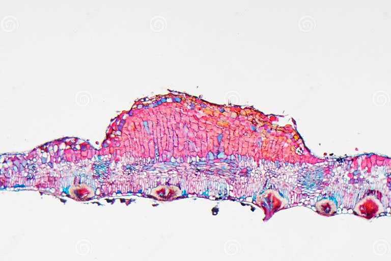Black Rust, Puccinia Graminis, on a Barberry Leaf Under the Microscope ...