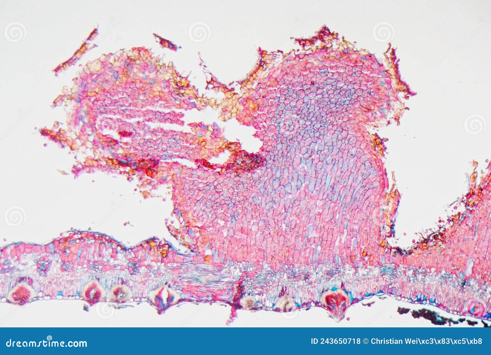 Black Rust, Puccinia Graminis, on a Barberry Leaf Under the Microscope ...