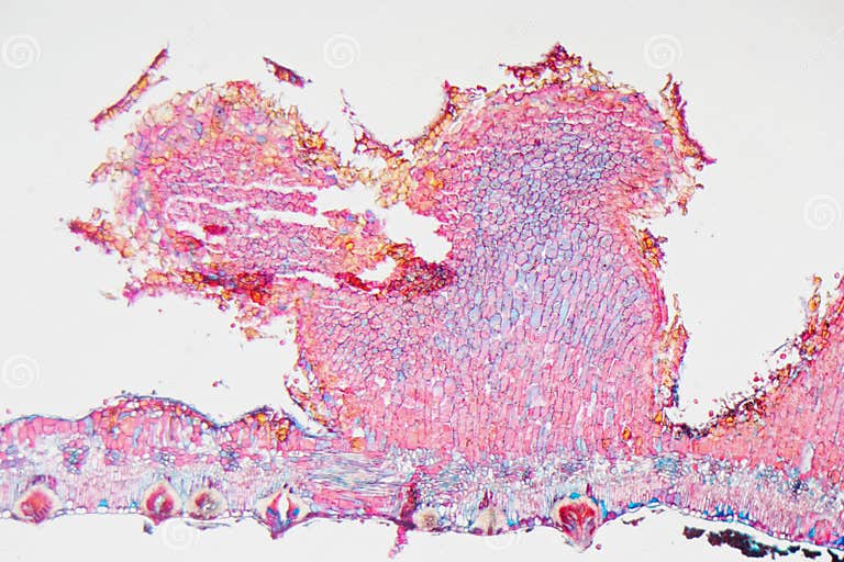 Black Rust, Puccinia Graminis, on a Barberry Leaf Under the Microscope ...