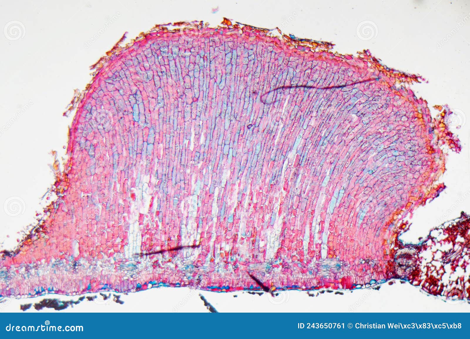 Black Rust, Puccinia Graminis, on a Barberry Leaf Under the Microscope ...