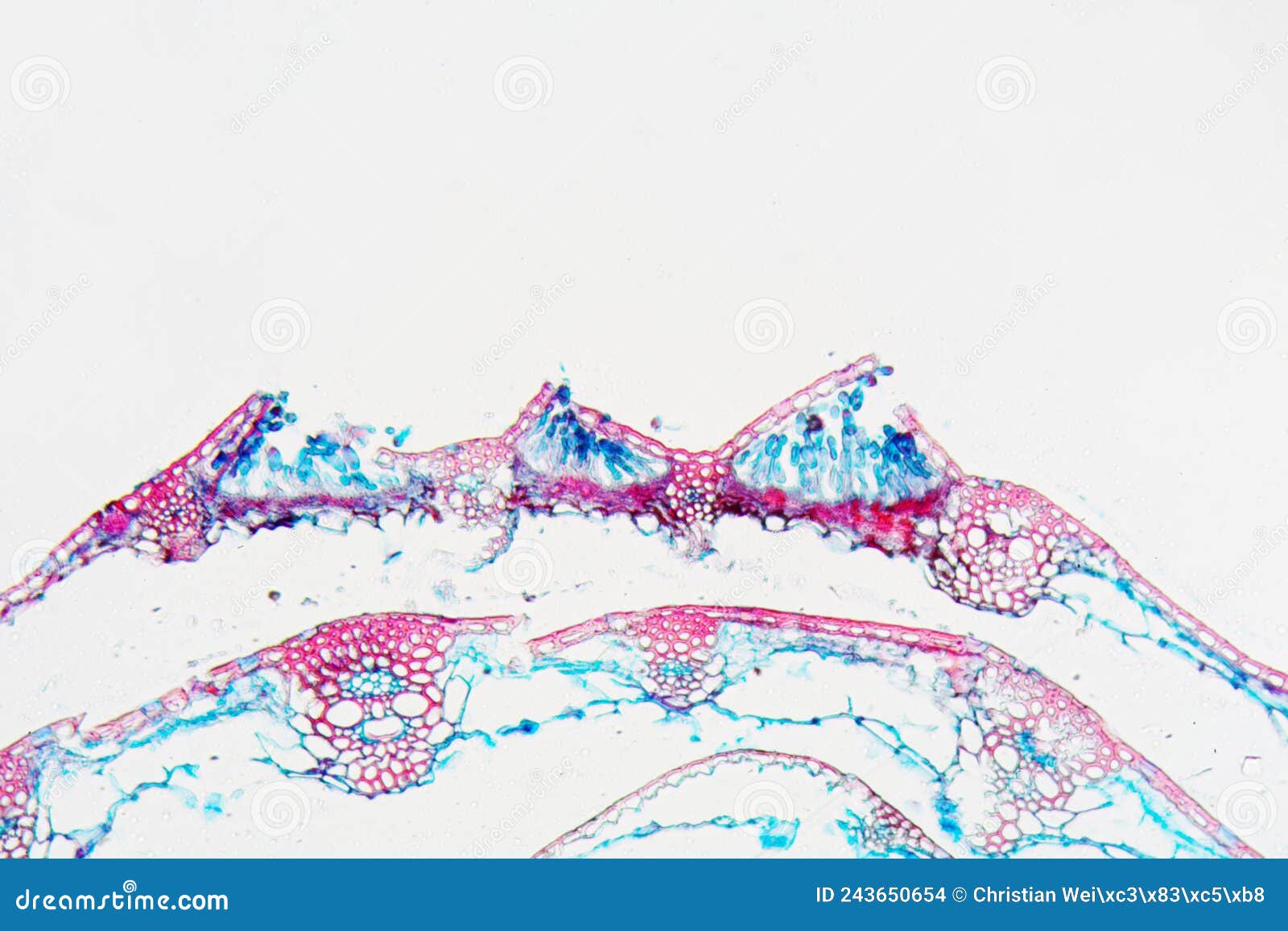 Black Rust, Puccinia Graminis, on a Wheat Leaf Under the Microscope ...