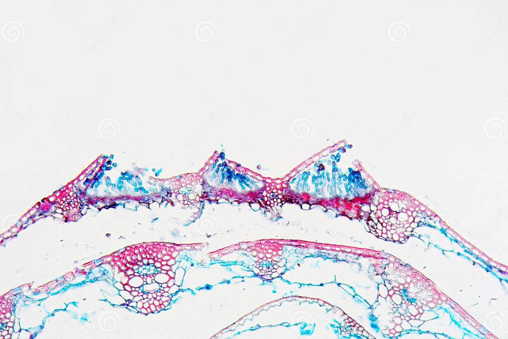 Black Rust, Puccinia Graminis, on a Wheat Leaf Under the Microscope ...