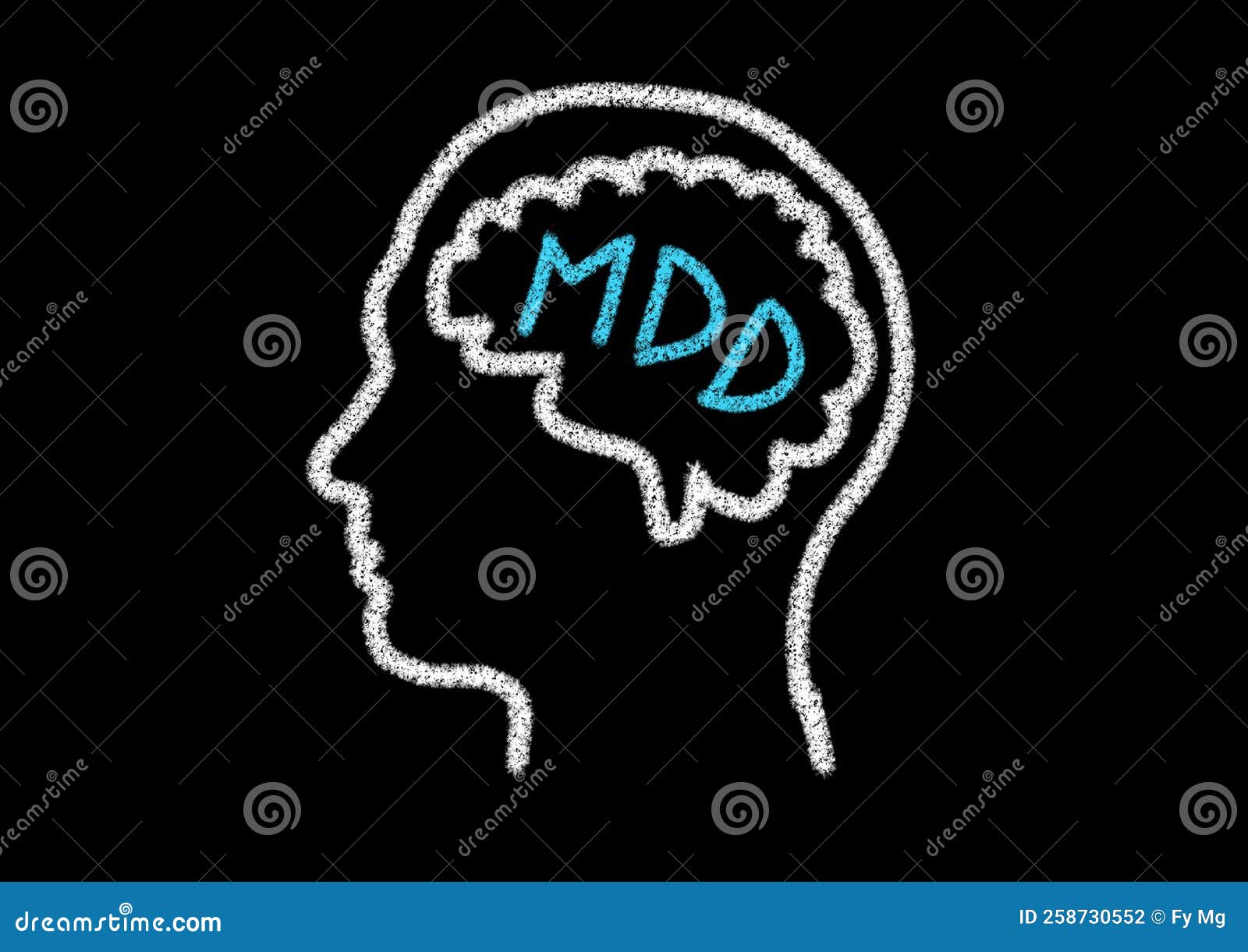 Blackboard Drawing of a Head with MDD on the Brain. MDD Stands for ...