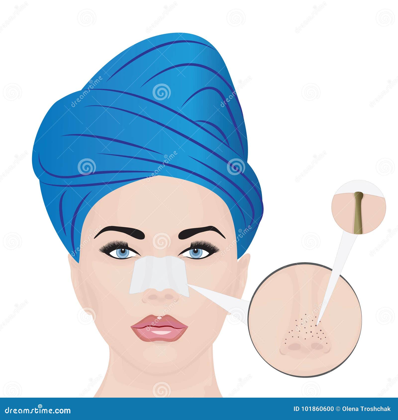 Blackheads on Nose. Treatment Stock Vector - Illustration of feminine ...