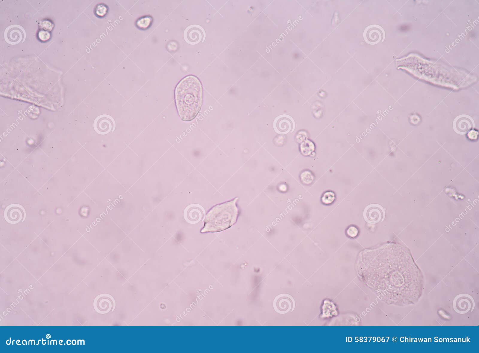 Bladder epithelial stock image. Image of cell, epithelium - 58379067