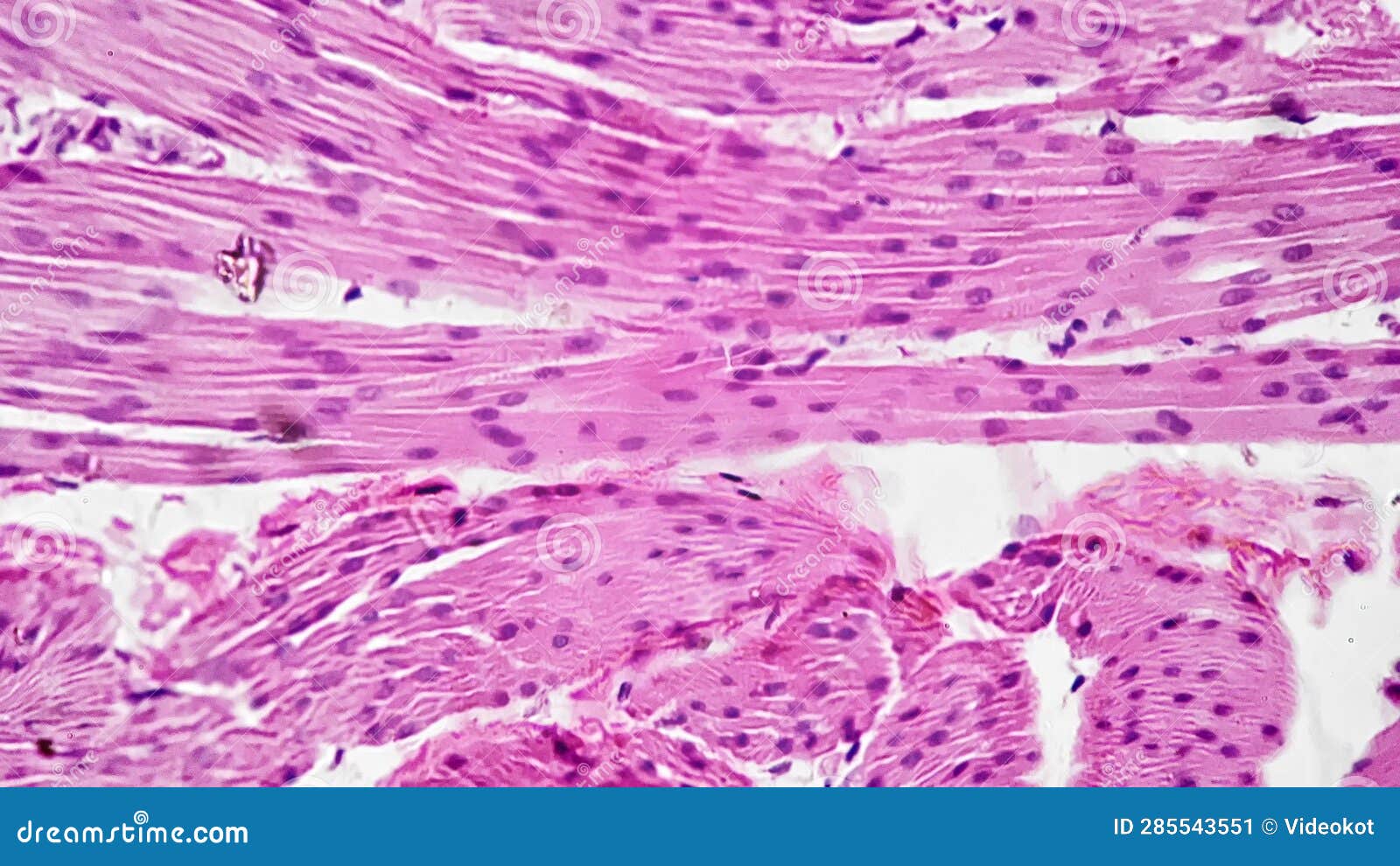 Bladder of Human Being in Section Filmed Under Microscope 400x for ...