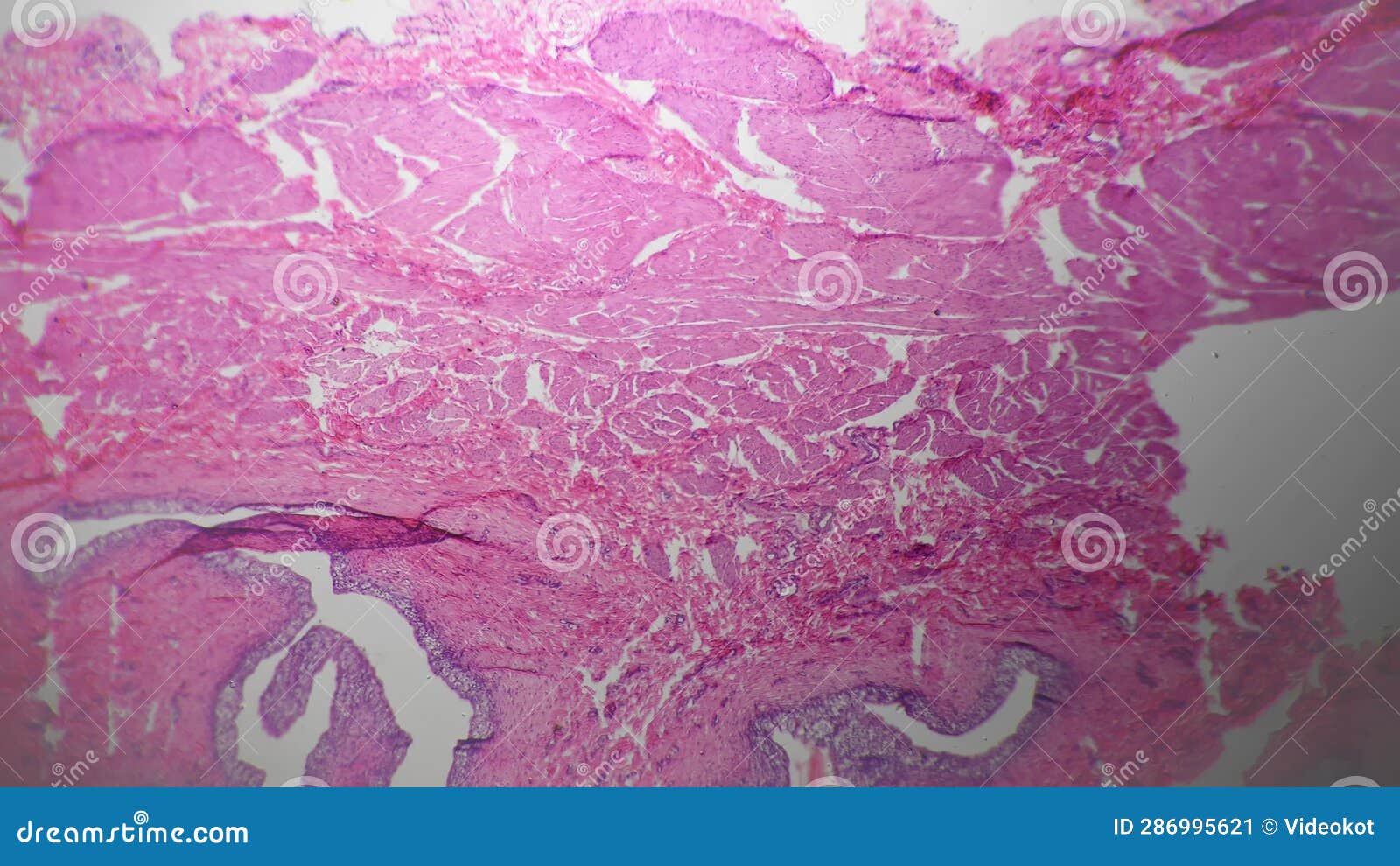 Bladder of Human Being in Section Filmed Under Microscope 40x for ...