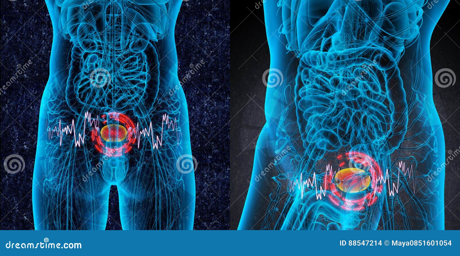 Bladder Pain Glomerulations 3d Illustrationon White Background ...
