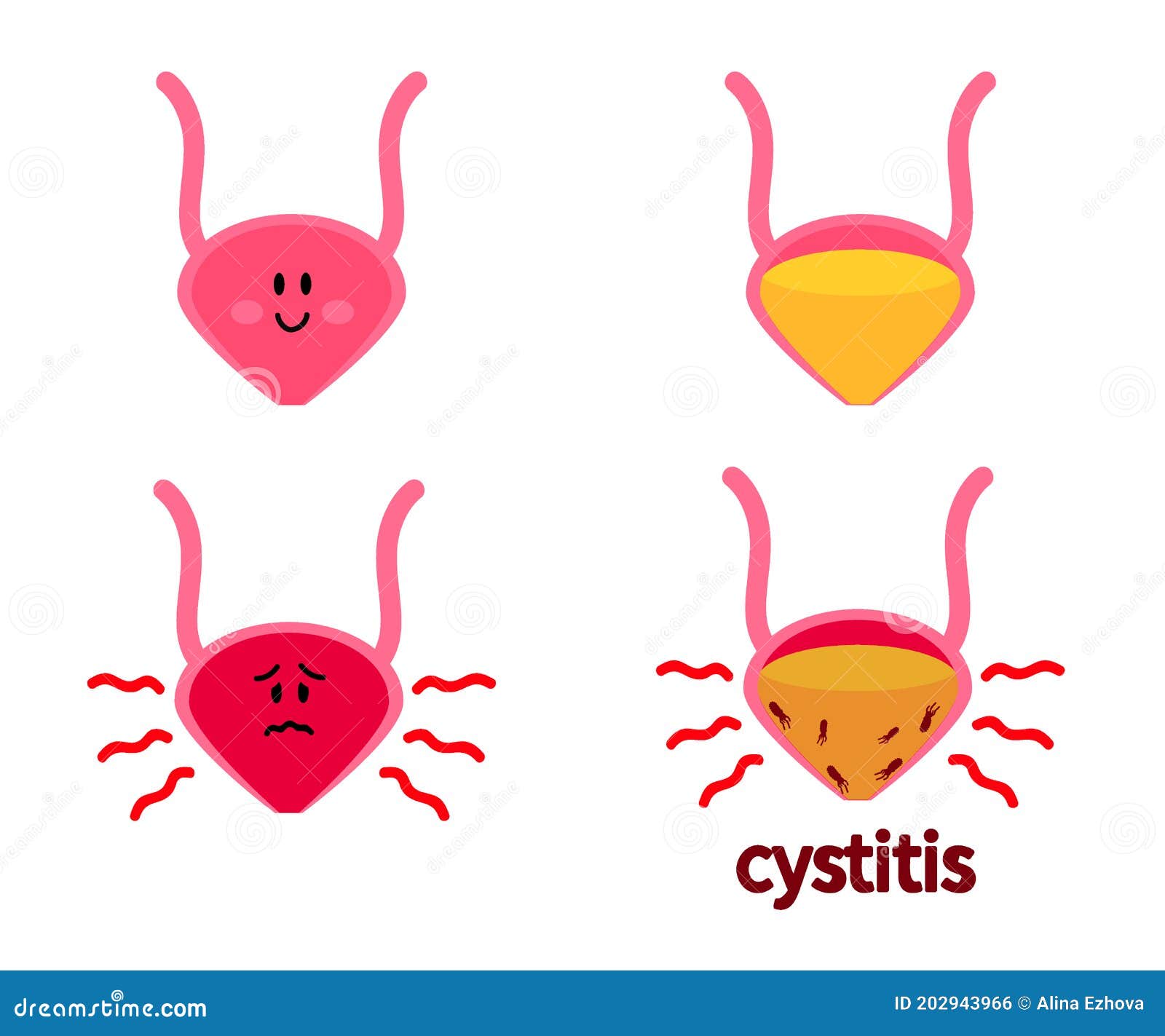 Bladder on a White Background. Cystitis. Symbol Stock Illustration ...