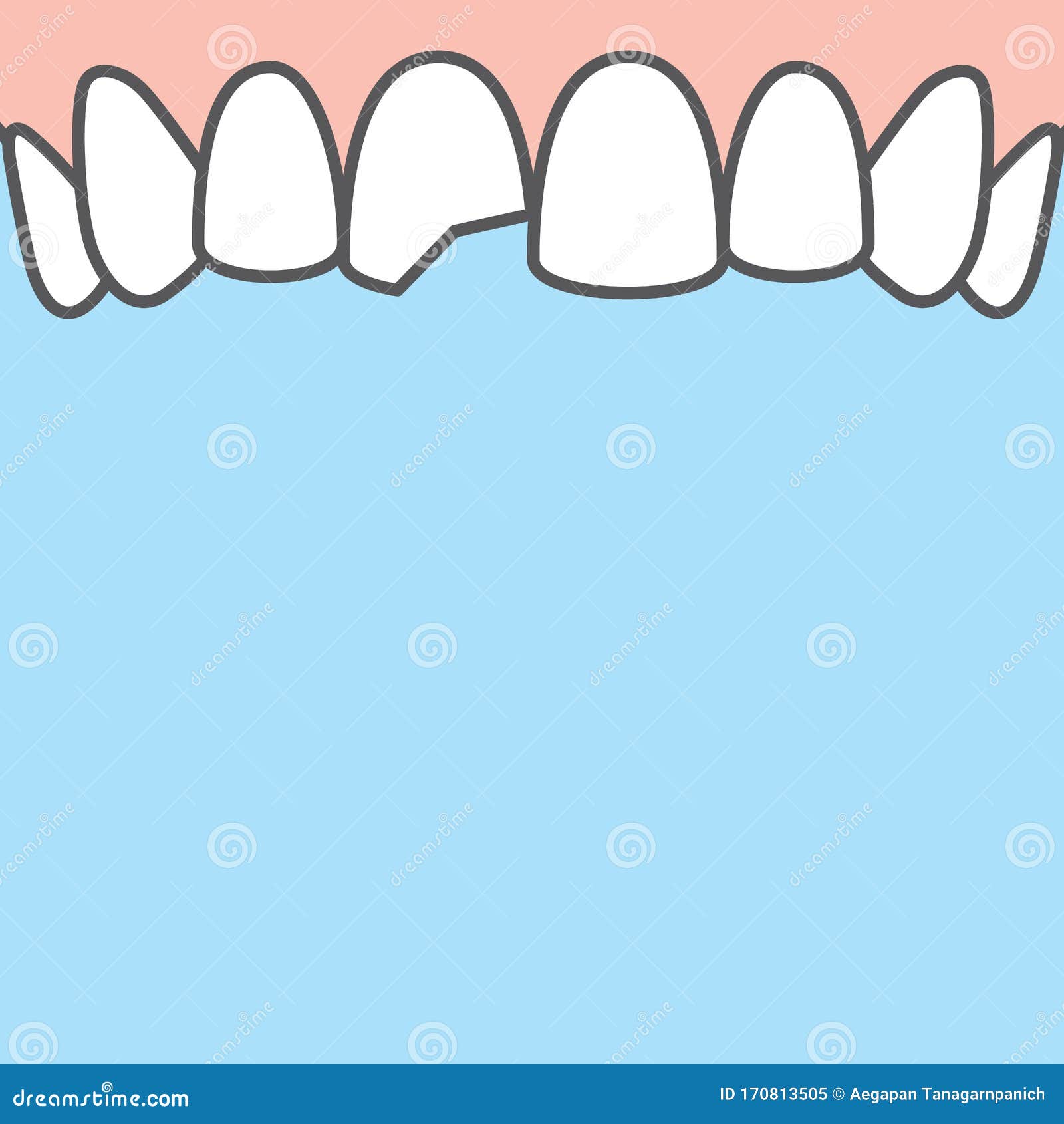 Blank Banner Upper Chipped Tooth Illustration Vector On Blue Background ...