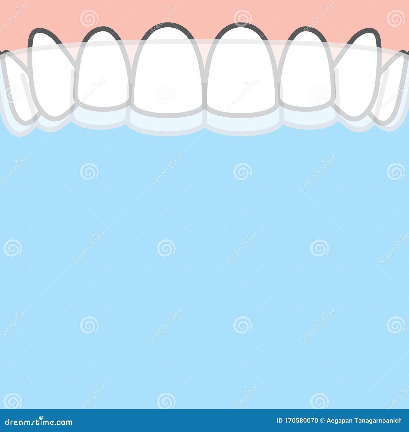 Banner Upper Attrition Bruxism Teeth Illustration Vector On Bl ...