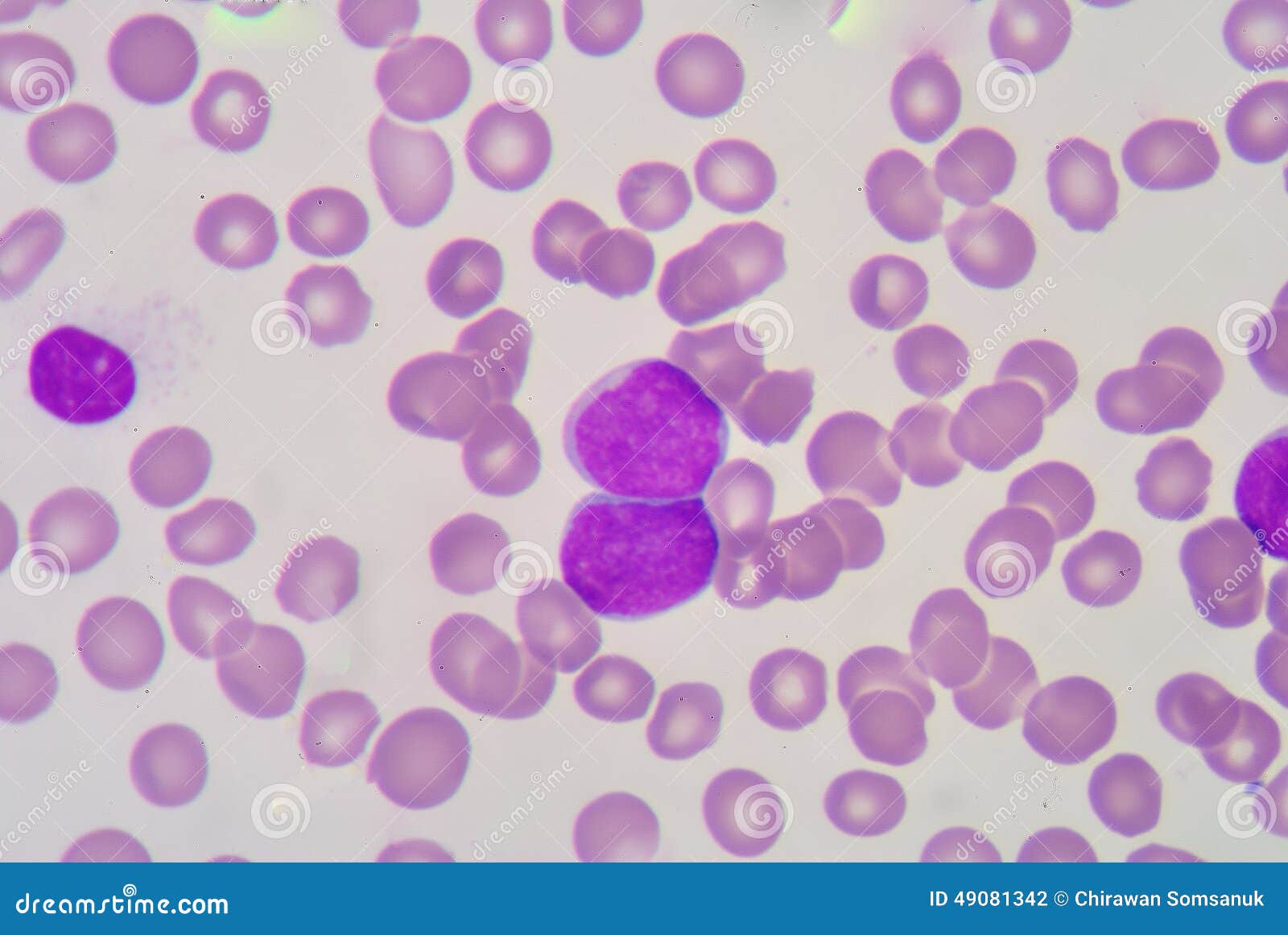 Blast cell stock photo. Image of nucleus, microscope - 49081342