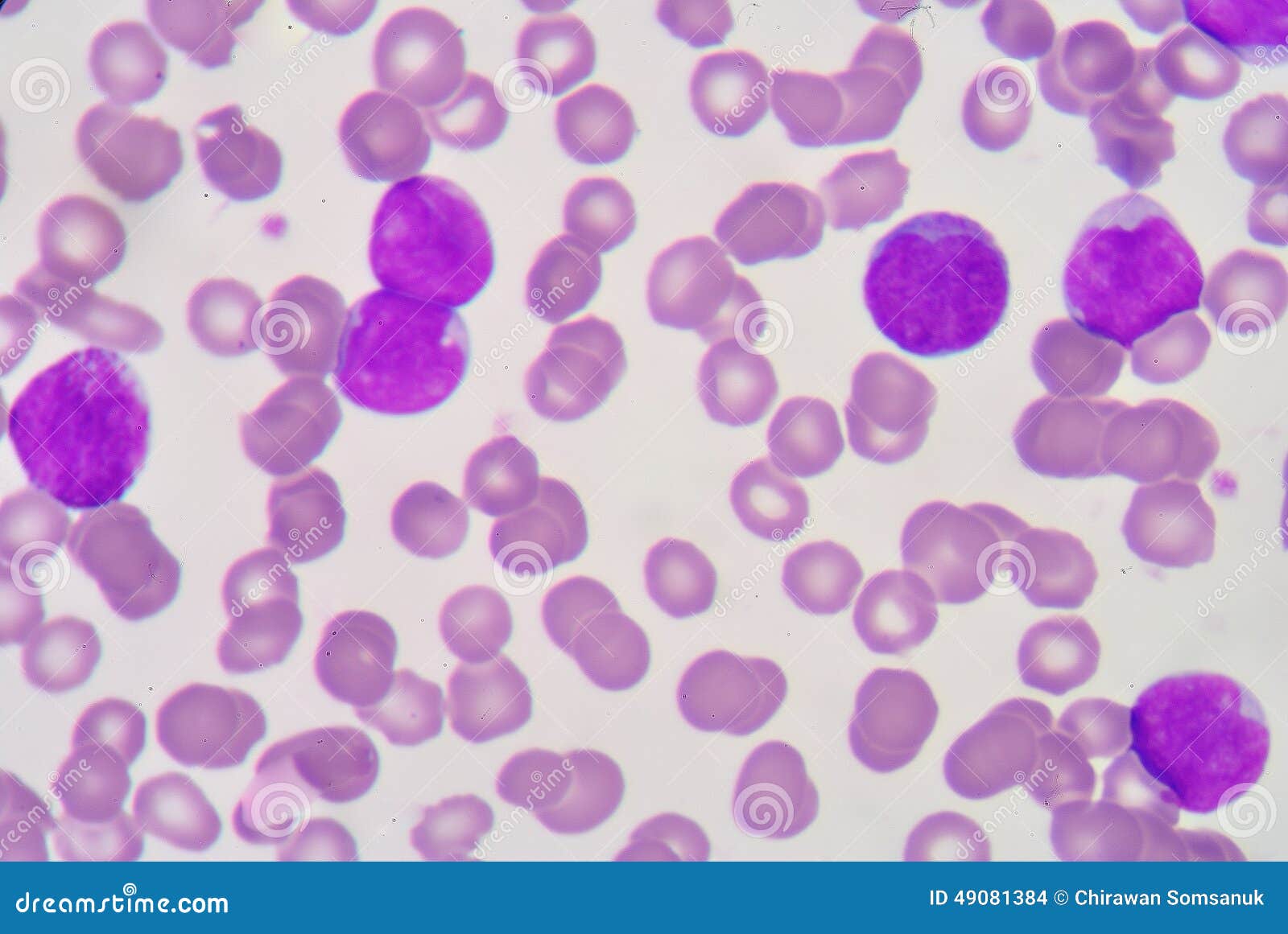 Blast cell stock photo. Image of nucleus, infection, cell - 49081384