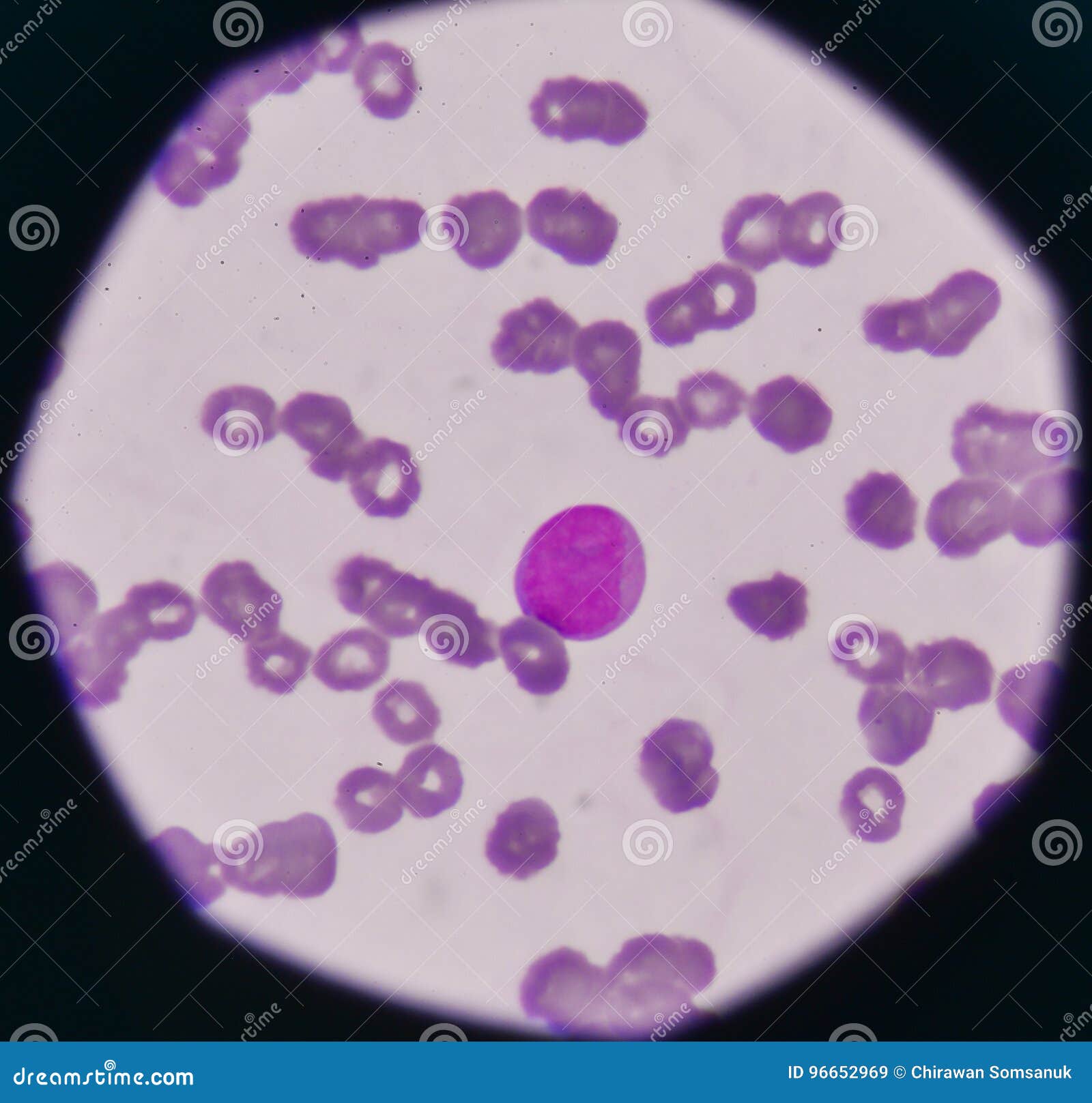 Blast Cell On Blood Smear. Stock Image | CartoonDealer.com #96652969