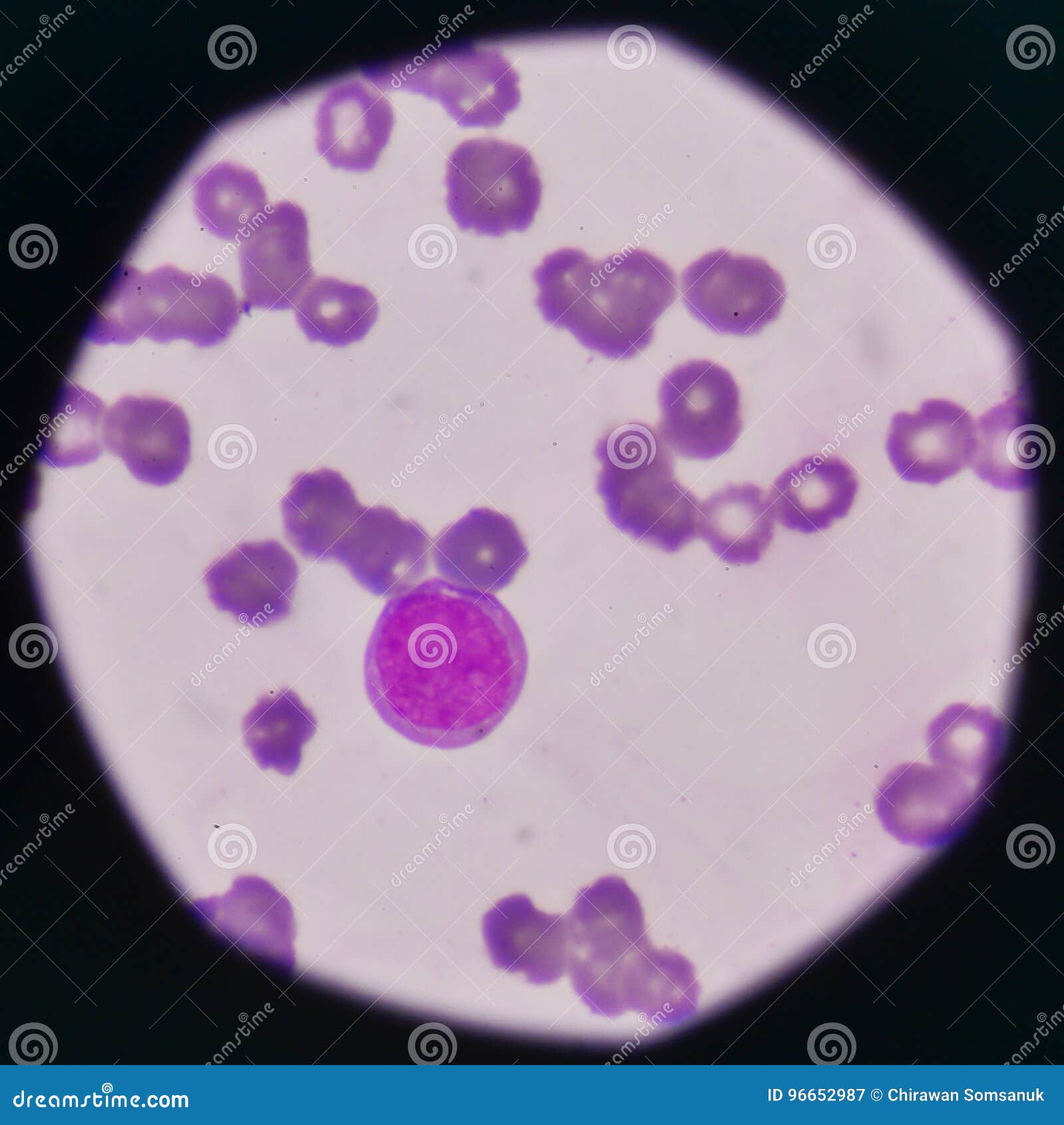 Blast Cell On Blood Smear. Stock Image | CartoonDealer.com #96652987