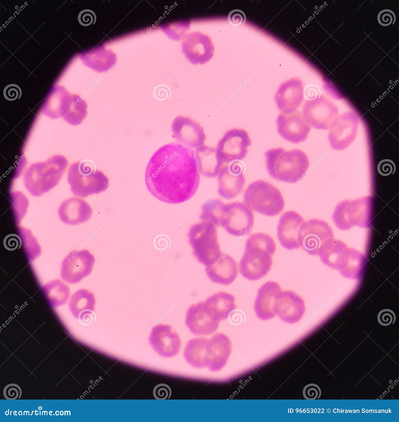 Blast Cell On Blood Smear. Stock Image | CartoonDealer.com #96652987