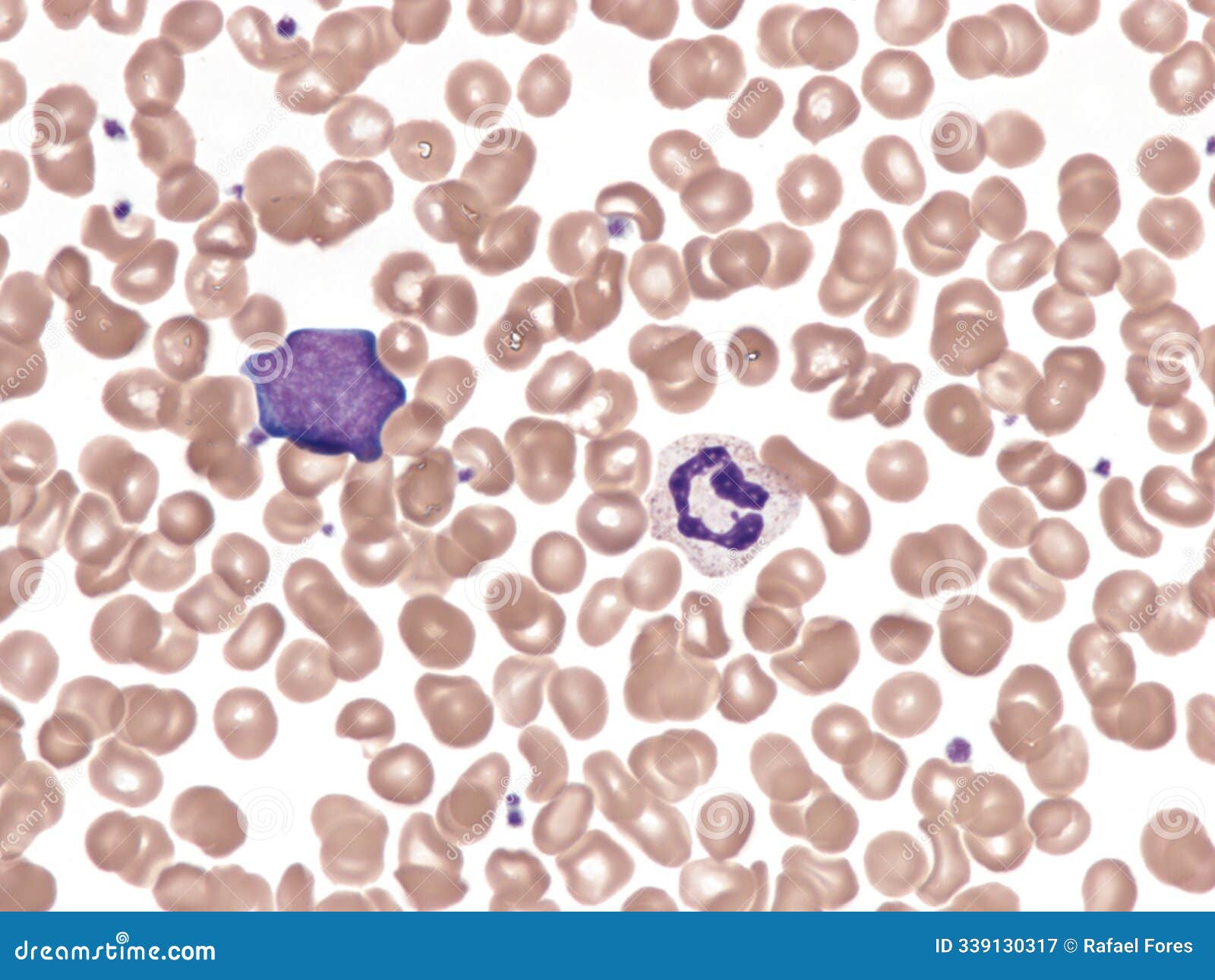 Peripheral Blood Smear (PBS) Royalty-Free Stock Photo | CartoonDealer ...