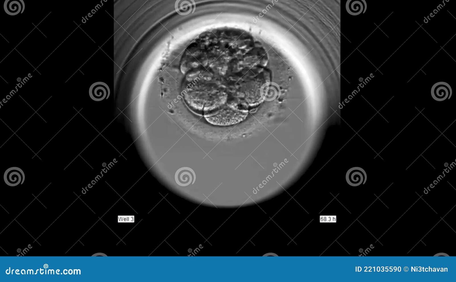 Blastocyst Formation Human Egg Fertility Cell Division Time Lapse Under ...