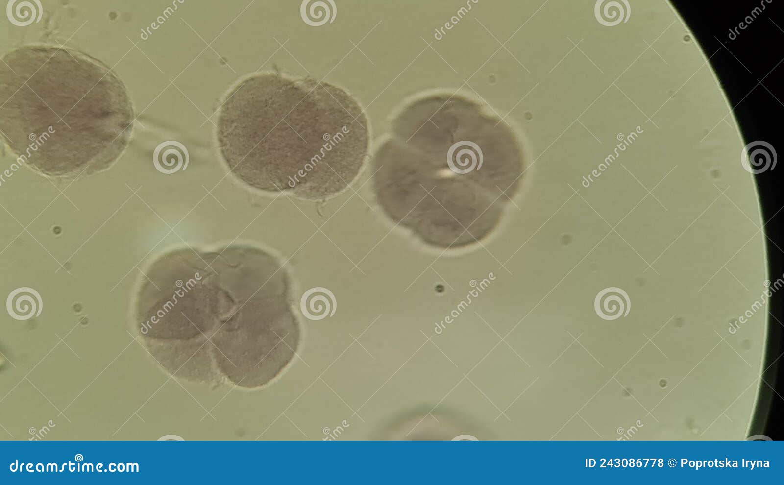 Blastomeres of Mammalian Egg, Microscopic Photo Stock Photo - Image of ...