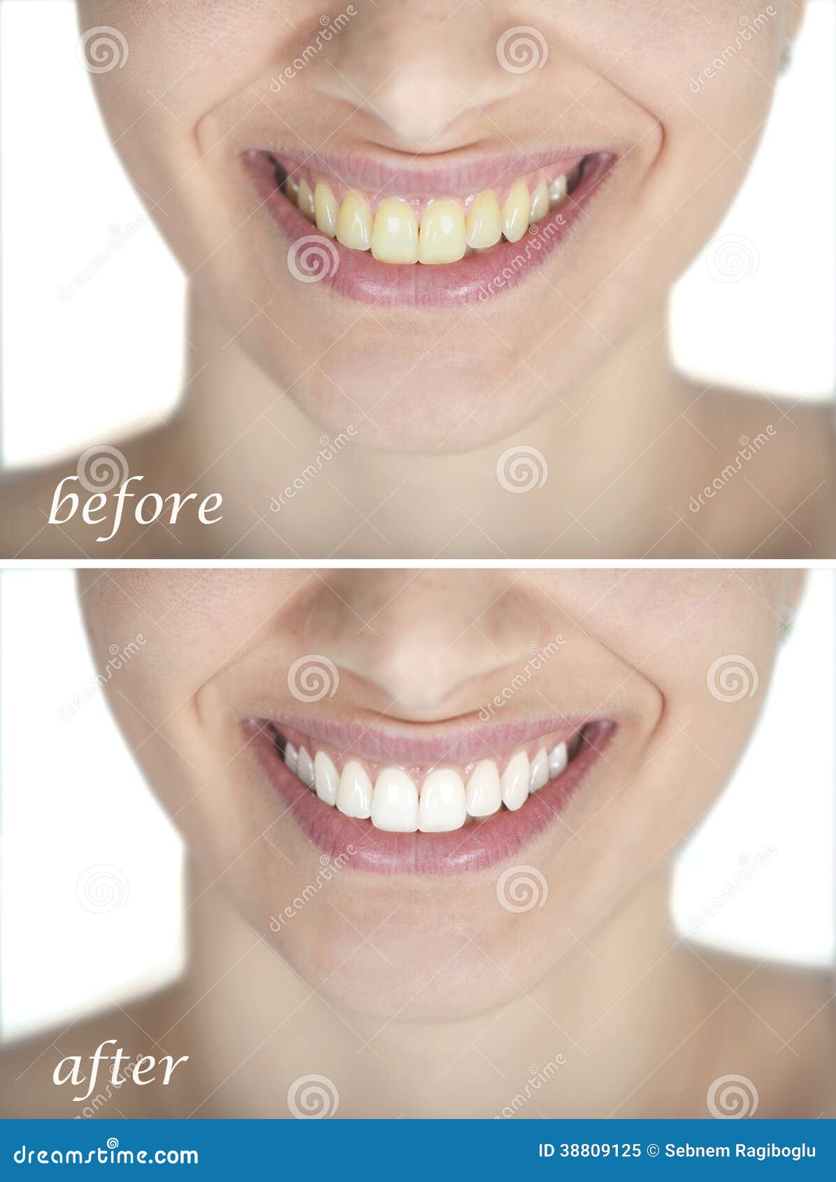 Bleaching stock image. Image of smiling, close, bleaching - 38809125