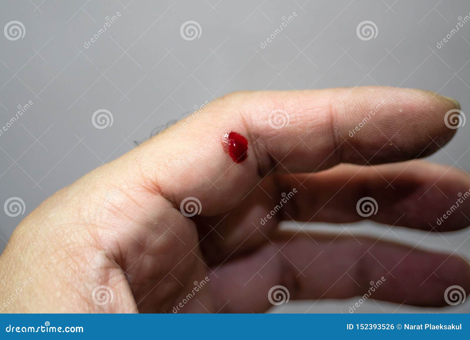 Bleeding finger stock photo. Image of blood, lancet - 152393526