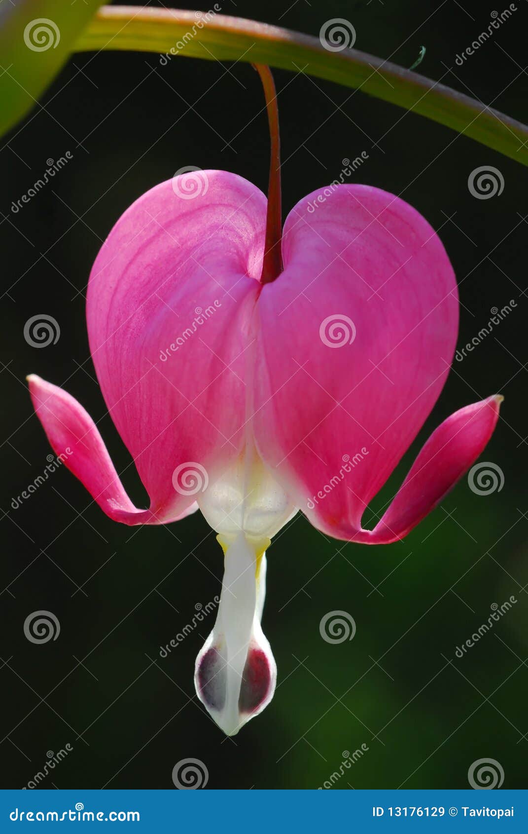 An Open Bleeding Wound On The Leg With Cleansed Skin, Bruises And ...