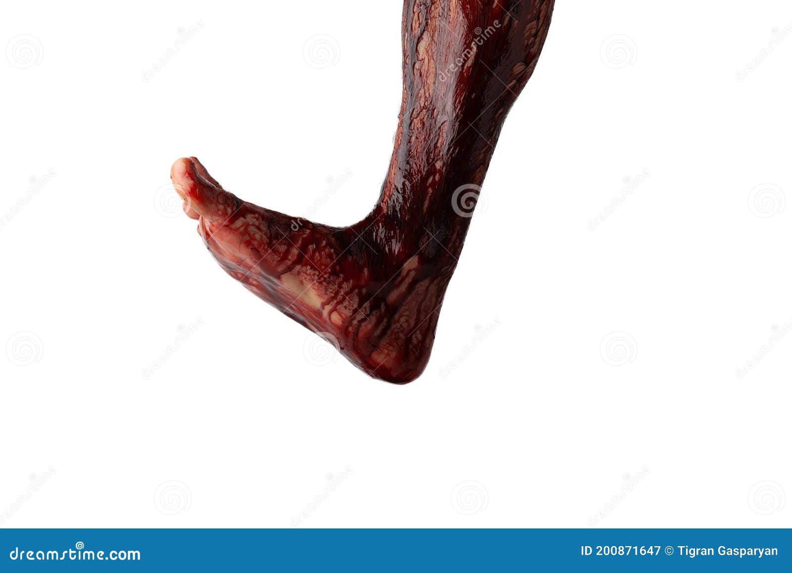 Bleeding Human Leg Isolated on White Background Stock Image - Image of ...