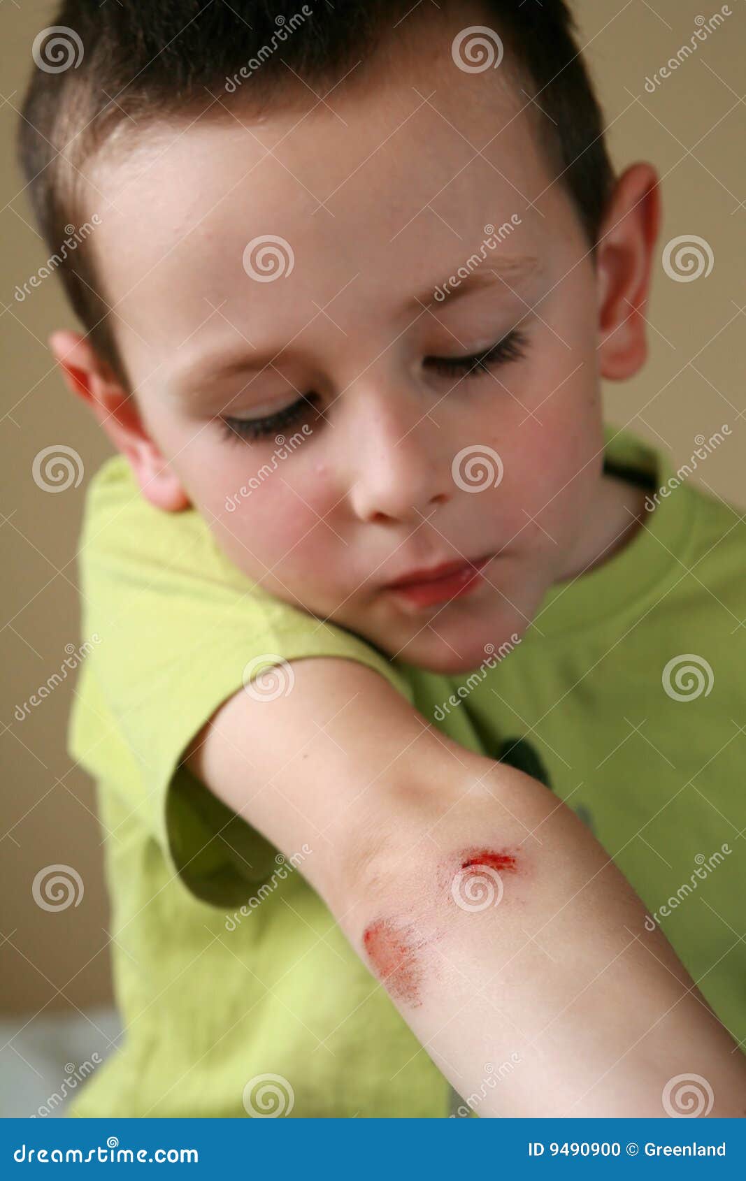 Bleeding injured boy stock photo. Image of scratch, care - 9490900