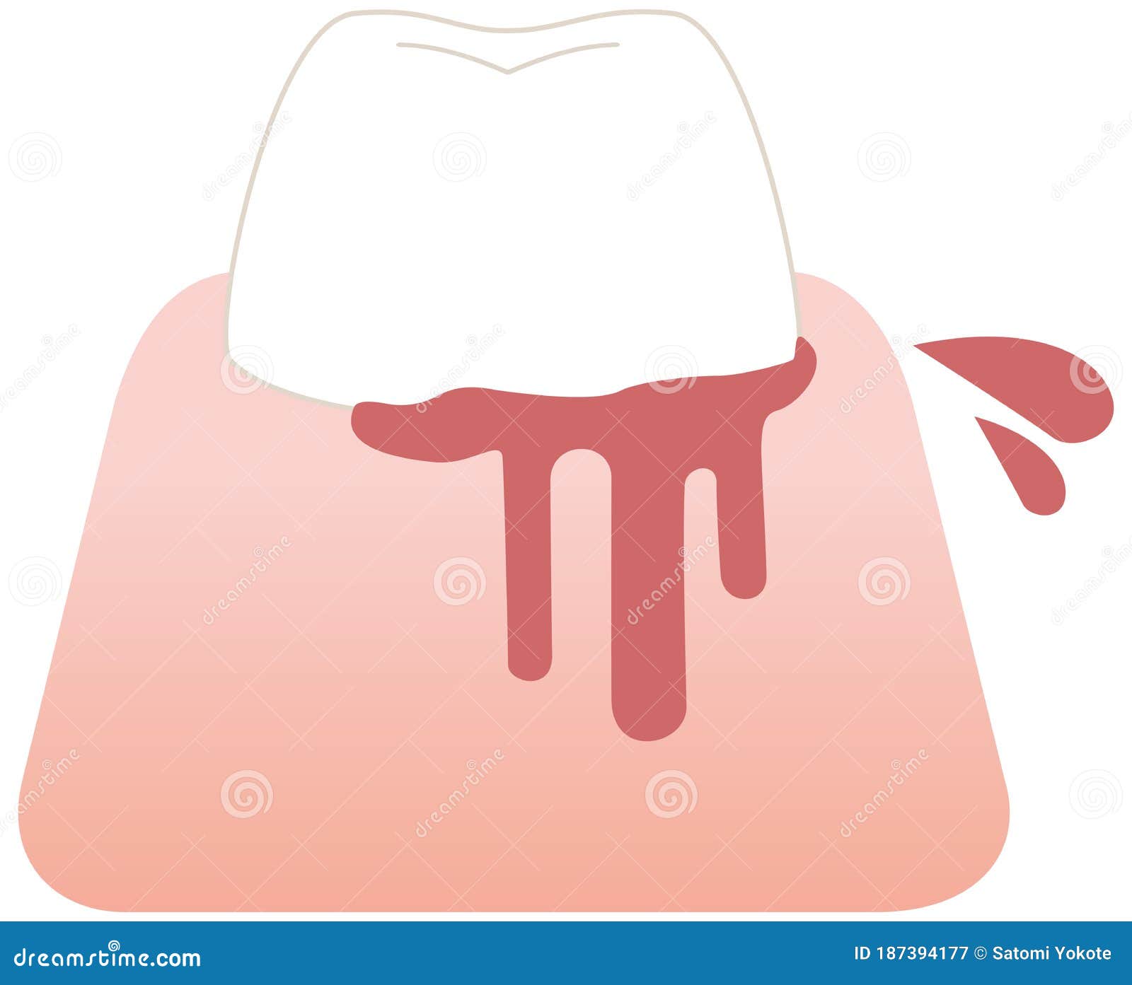 Bleeding Painful Teeth Illustration Vector Stock Vector - Illustration ...