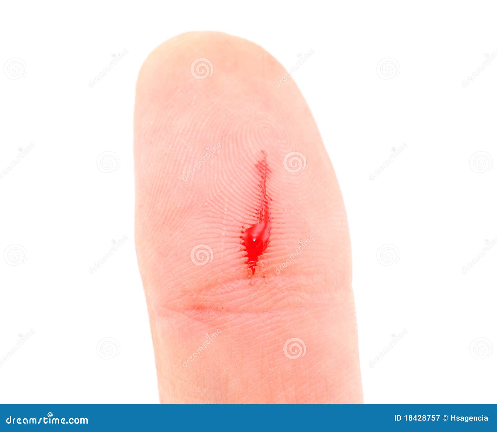 Bleeding thumb finger stock image. Image of wound, bleed - 18428757
