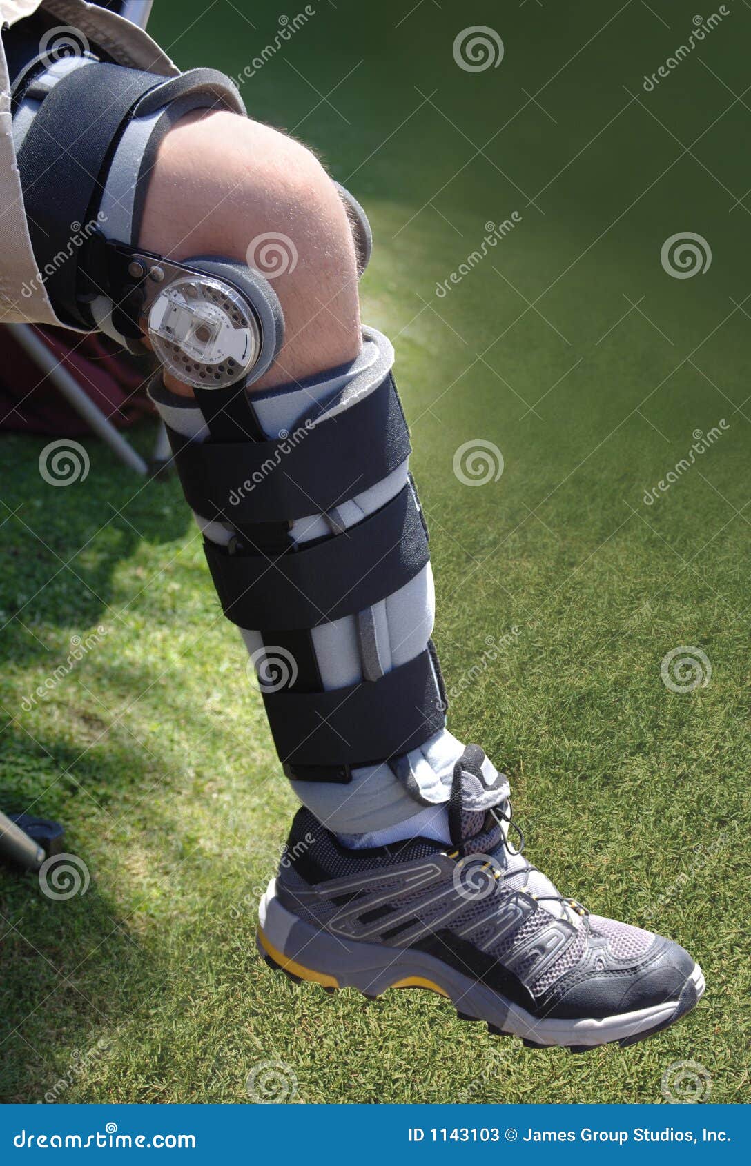 Blessure au genou image stock. Image du entorse, patte - 1143103