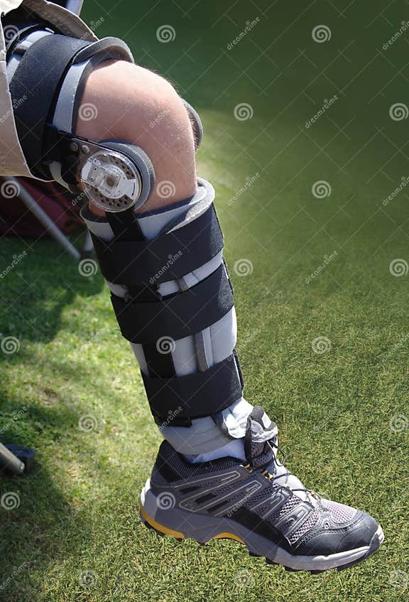 Blessure au genou image stock. Image du entorse, patte - 1143103