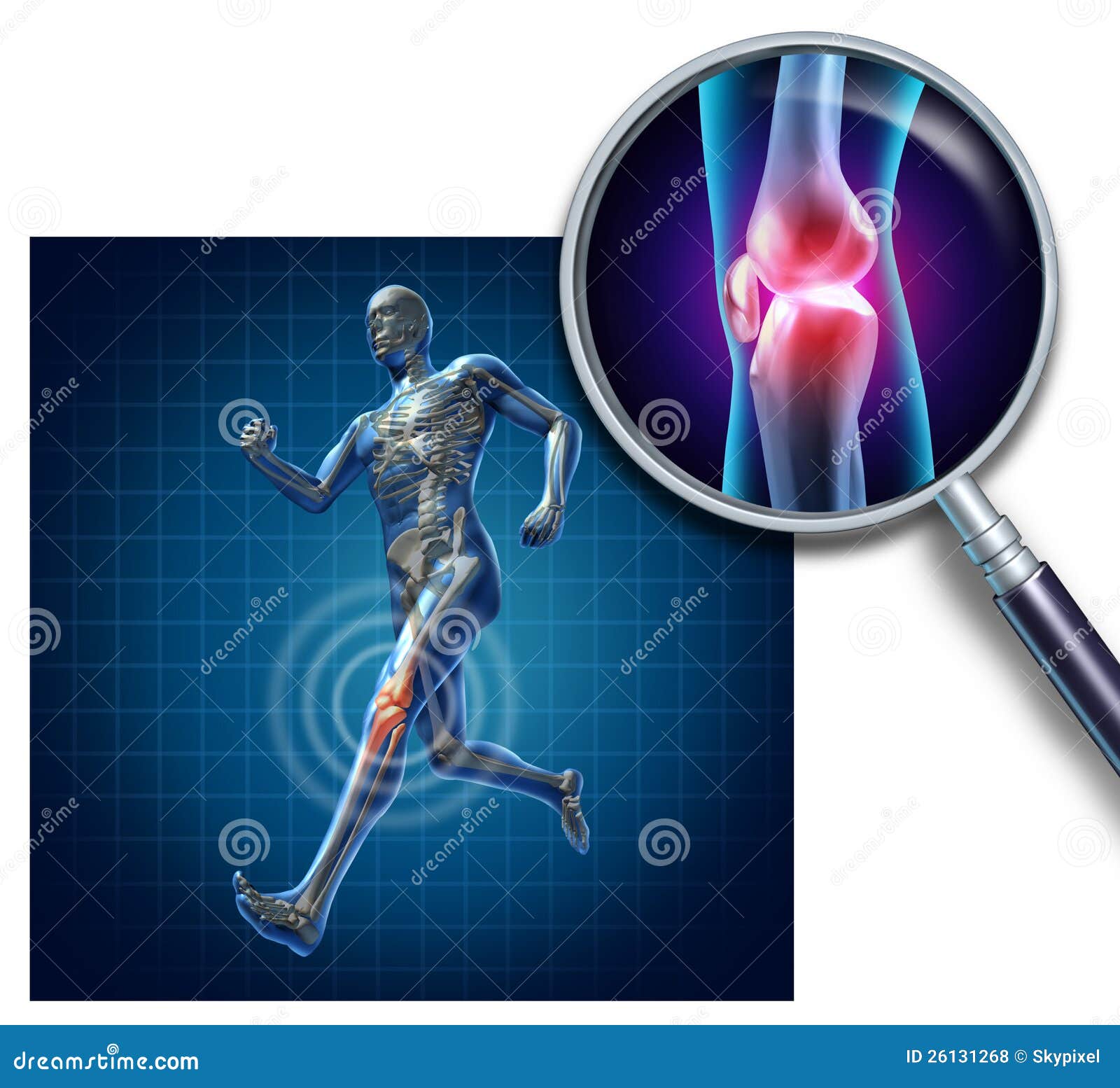 Blessure Au Genou De Sports Illustration Stock - Illustration du ...