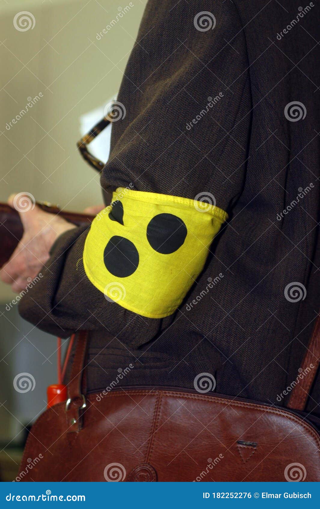 Blind Loop on a Persons Arm Stock Photo - Image of medical, visual ...