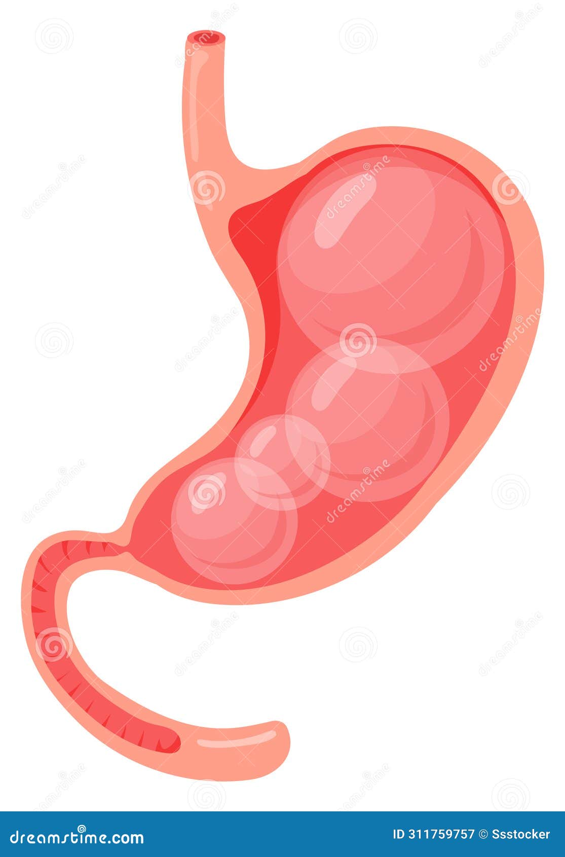 Bloating Stomach Cartoon Icon. Digestive System Problem | CartoonDealer ...