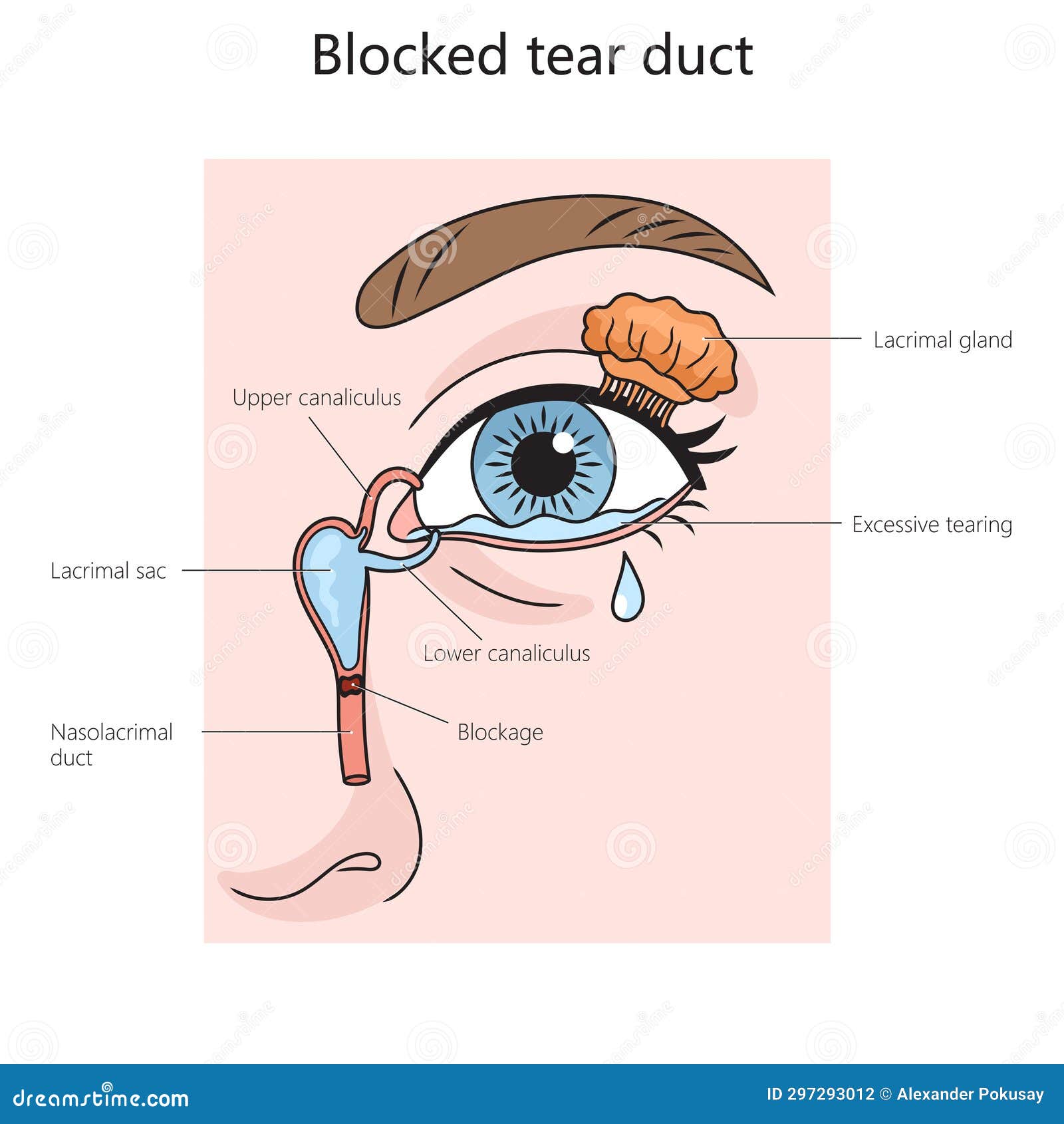 Blocked Tear Duct Diagram Medical Science Stock Vector - Illustration ...
